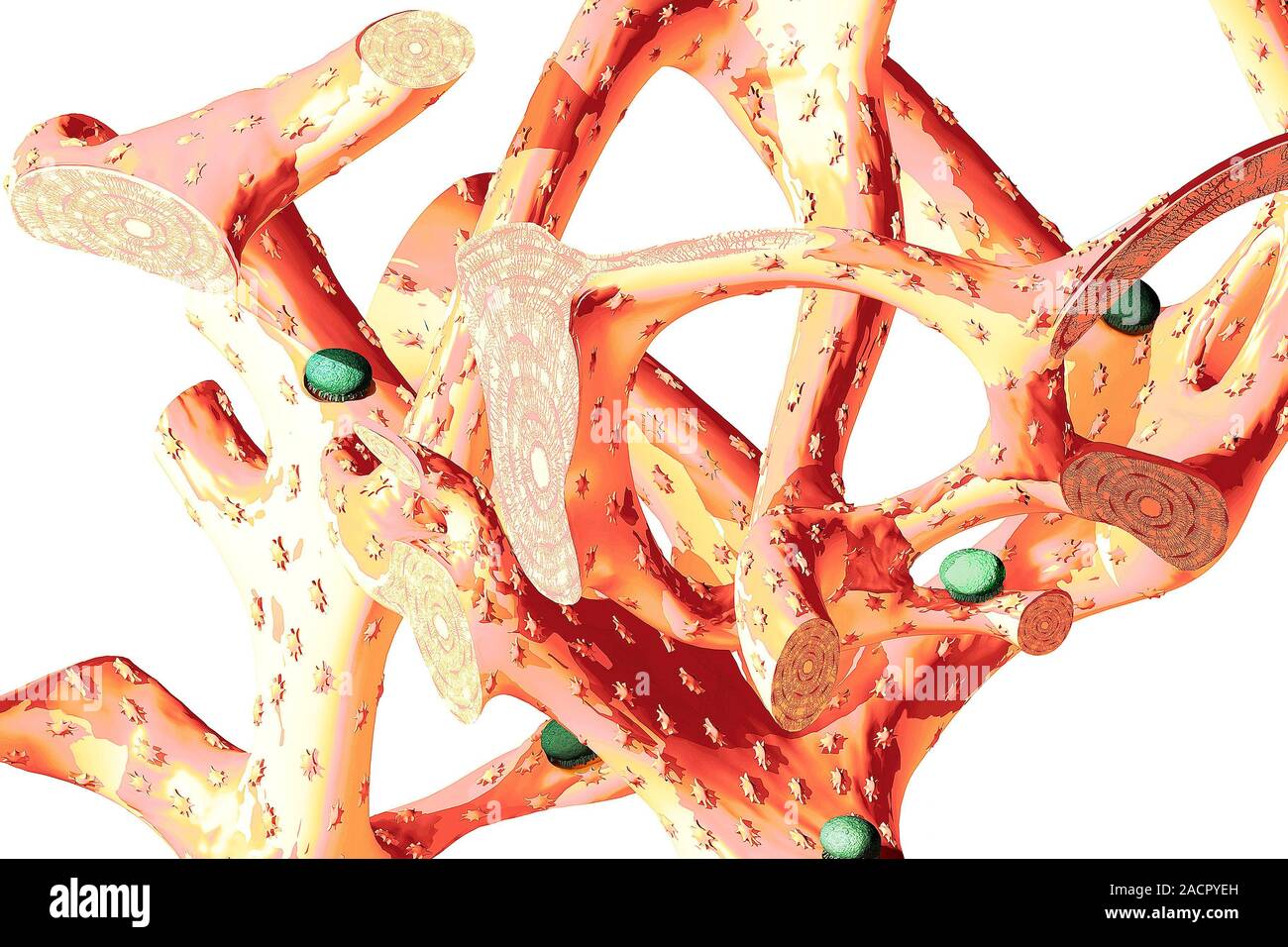 Bone structure. Computer artwork showing bone trabeculae. Trabeculae ...