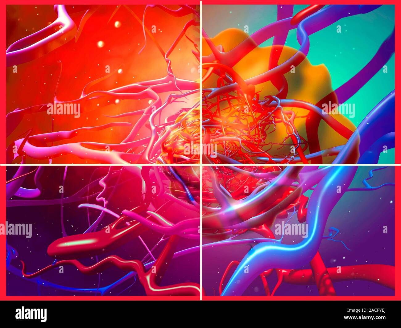 Cancer blood supply, conceptual image. Computer artwork representing ...