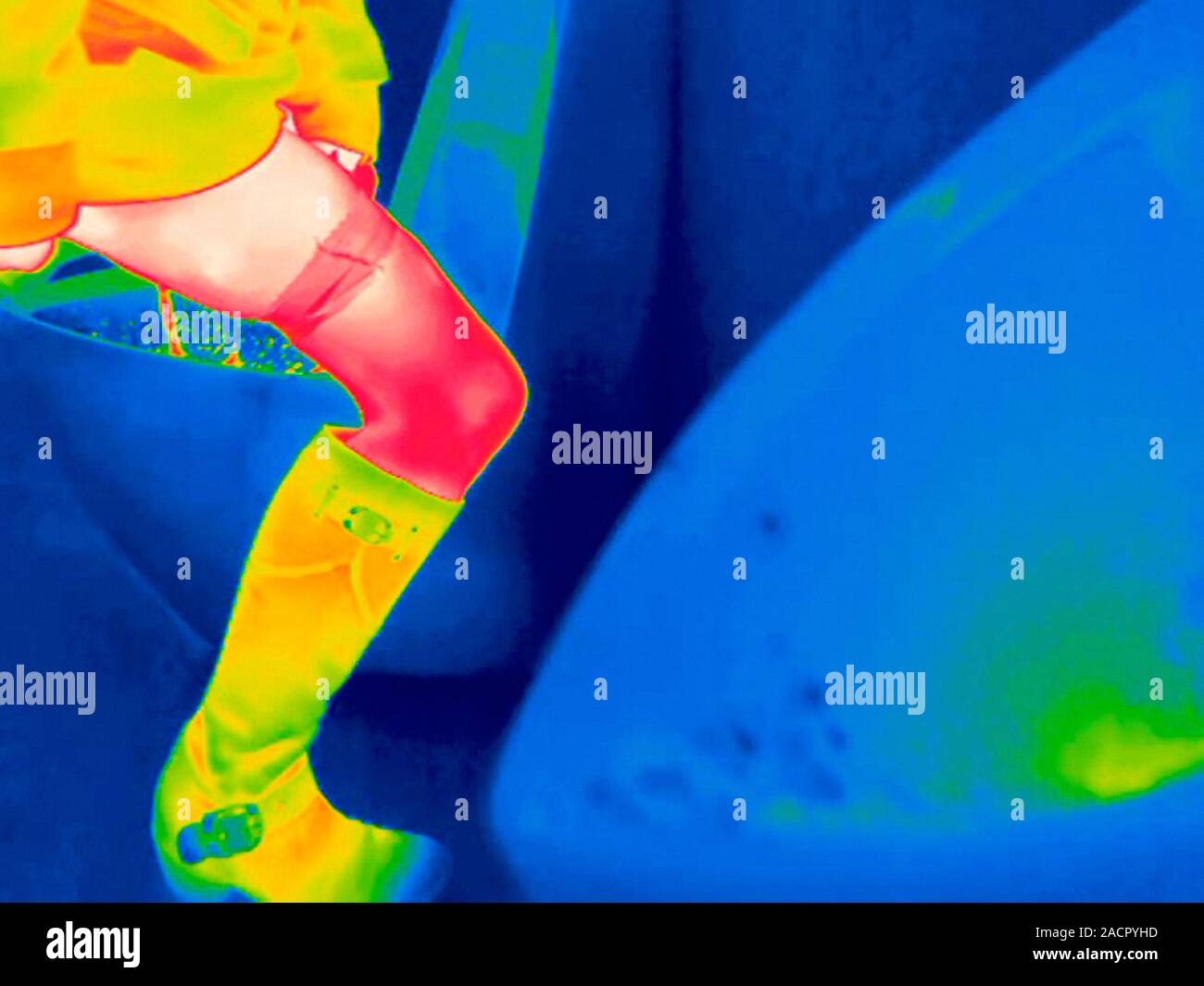 Woman using a urinal. Thermogram of a woman urinating in a urinal. The ...
