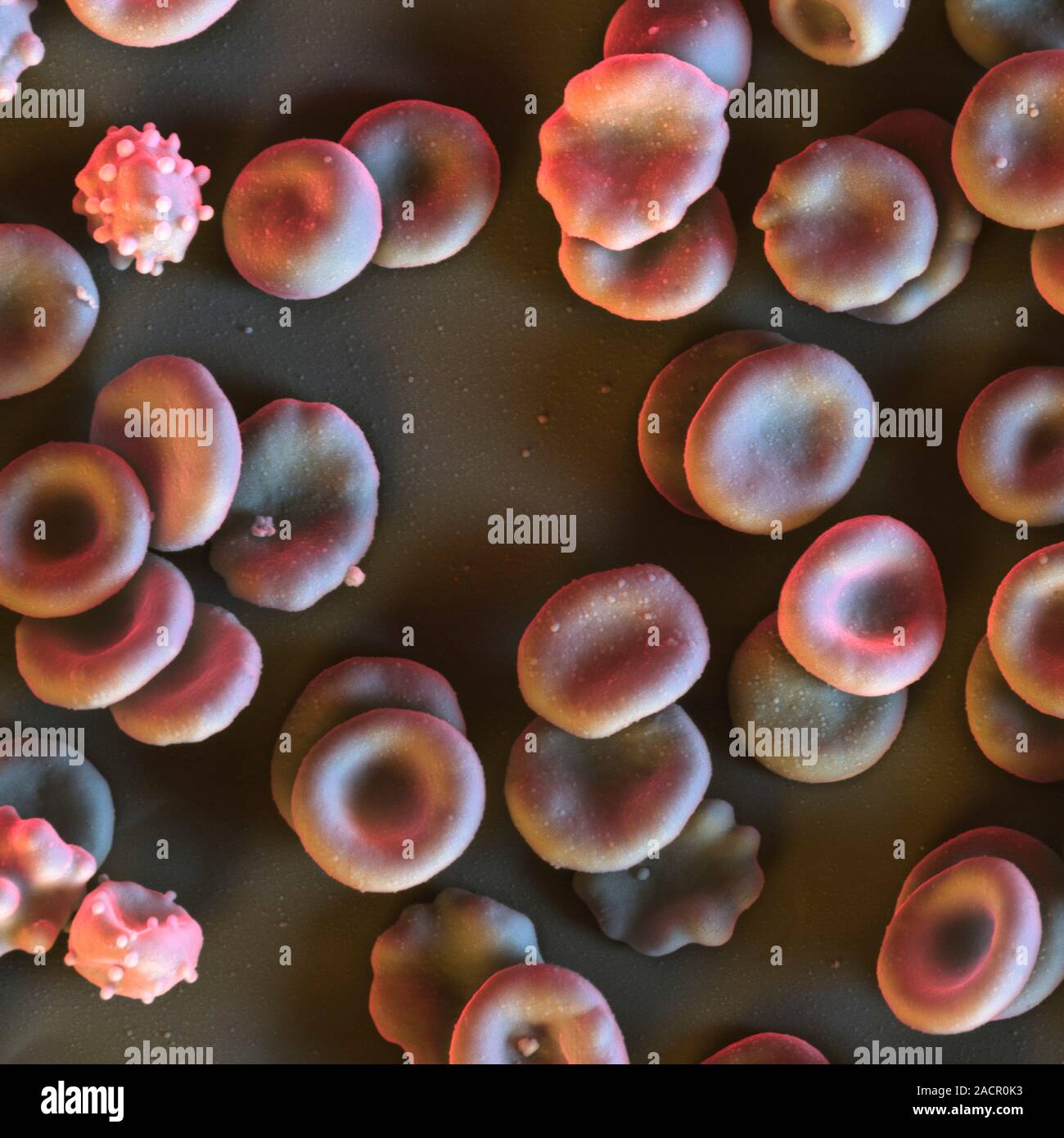 Red blood cells. Coloured scanning electron micrograph (SEM) of red ...