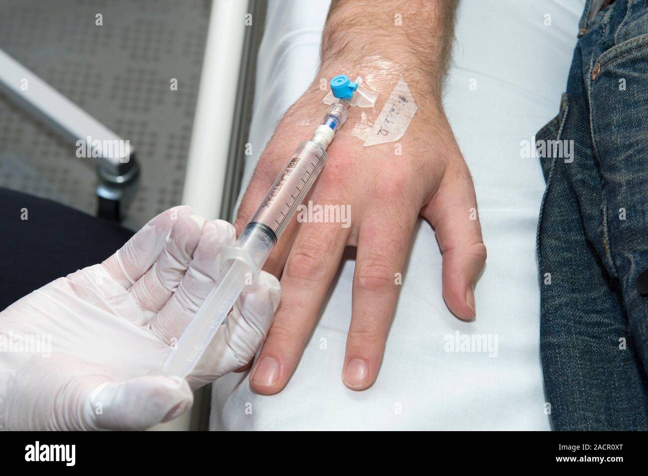 Cannula inserted into a vein of the hand before an intravenous (IV ...