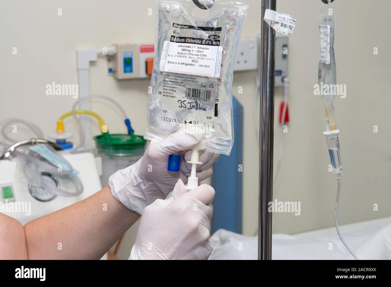 Intravenous (IV) drip bag containing a saline solution (sodium chloride ...