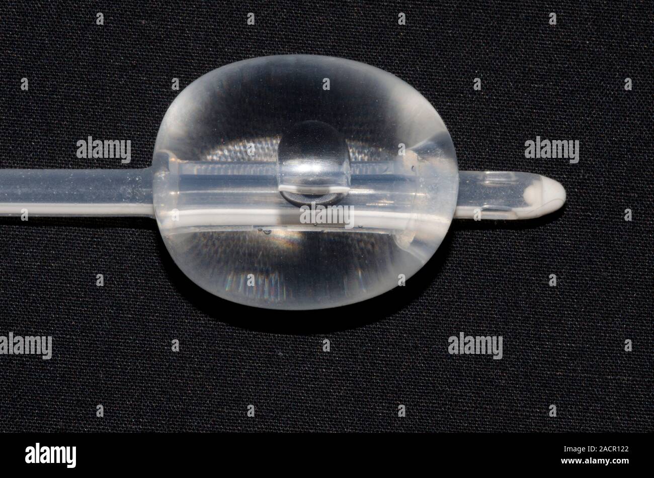 Tip of an inflated urinary catheter, a device that is inserted into the ...