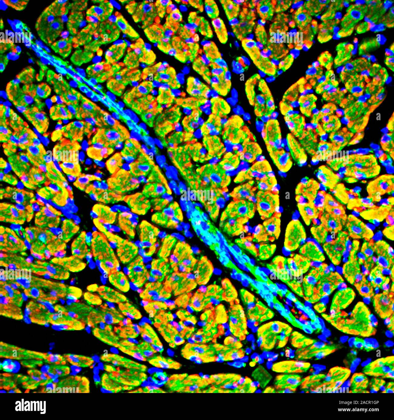 Heart muscle. Fluorescence deconvolution micrograph of a section ...