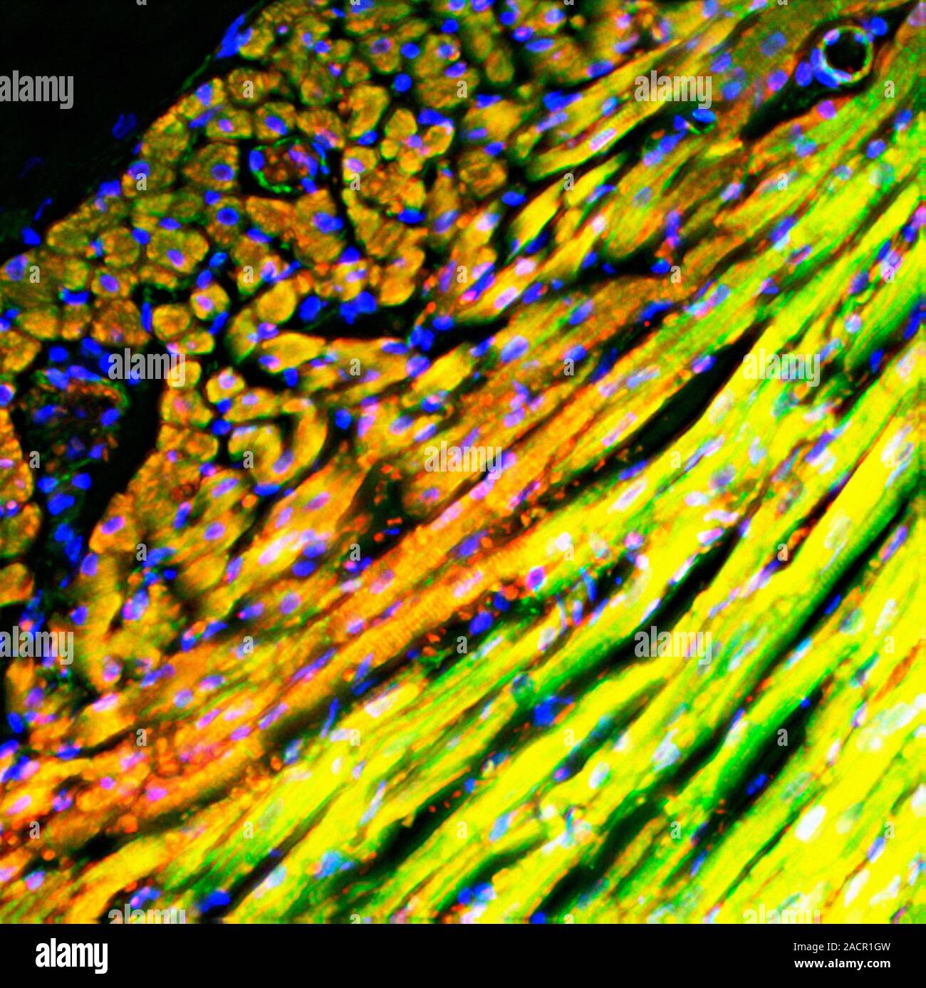 Heart muscle. Fluorescence deconvolution micrograph of a section ...