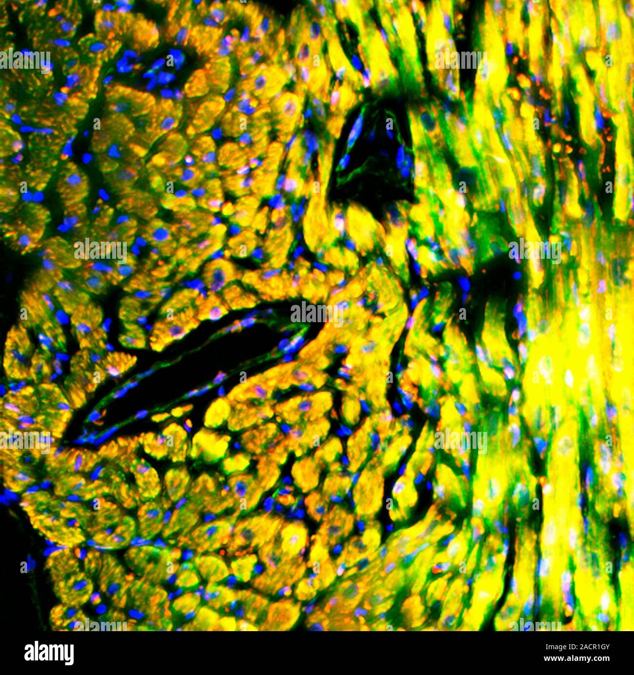 Heart muscle. Fluorescence deconvolution micrograph of a section ...
