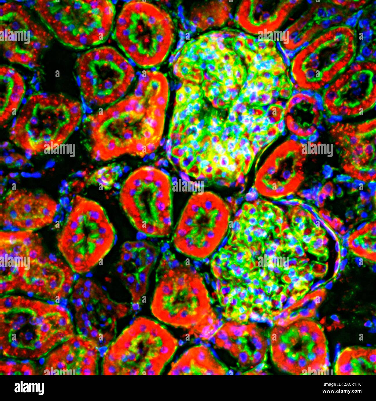 Kidney tissue. Fluorescence deconvolution micrograph of a section ...