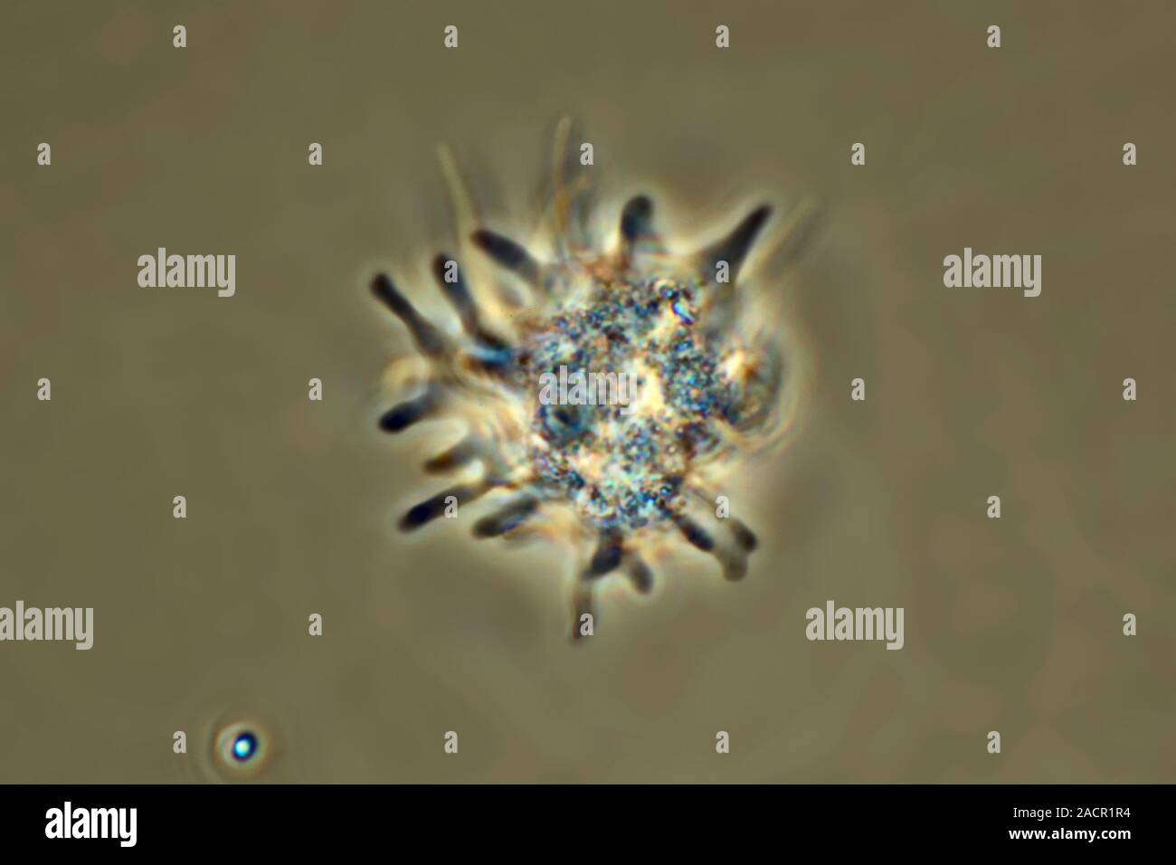 Amoeba protozoan. Phase-contrast light micrograph of an Amoeba sp. protozoan, showing its ...