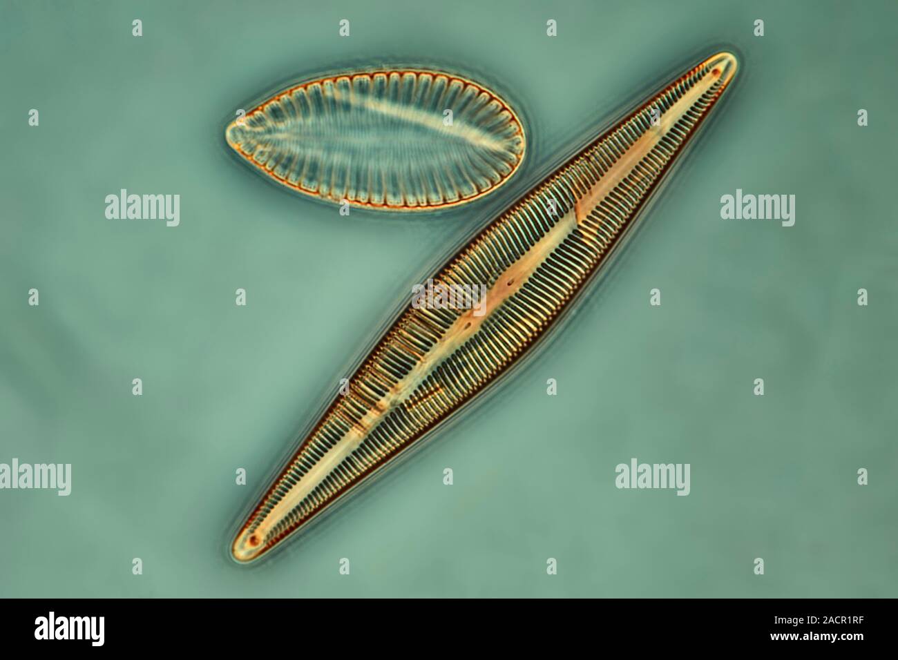 Diatoms. Interphase contrast light micrograph of two differently shaped ...