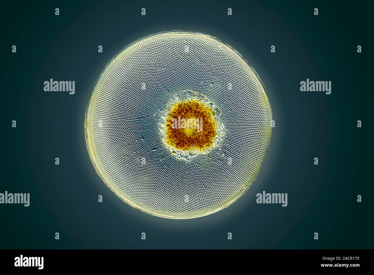 Diatom. Differential interference contrast (DIC) light micrograph of a ...