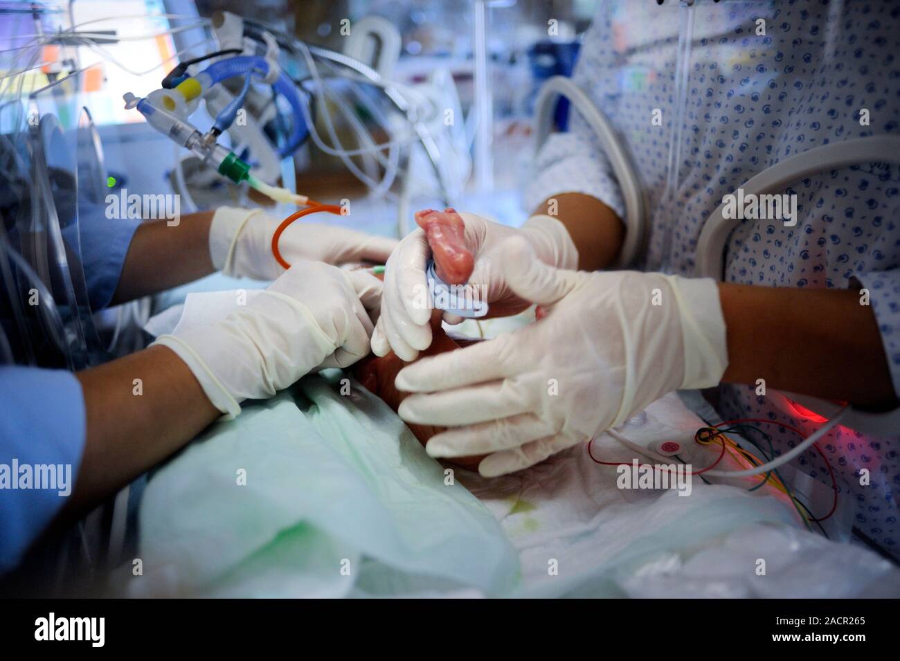 Premature baby intensive care unit. Nurses with a premature baby in an ...