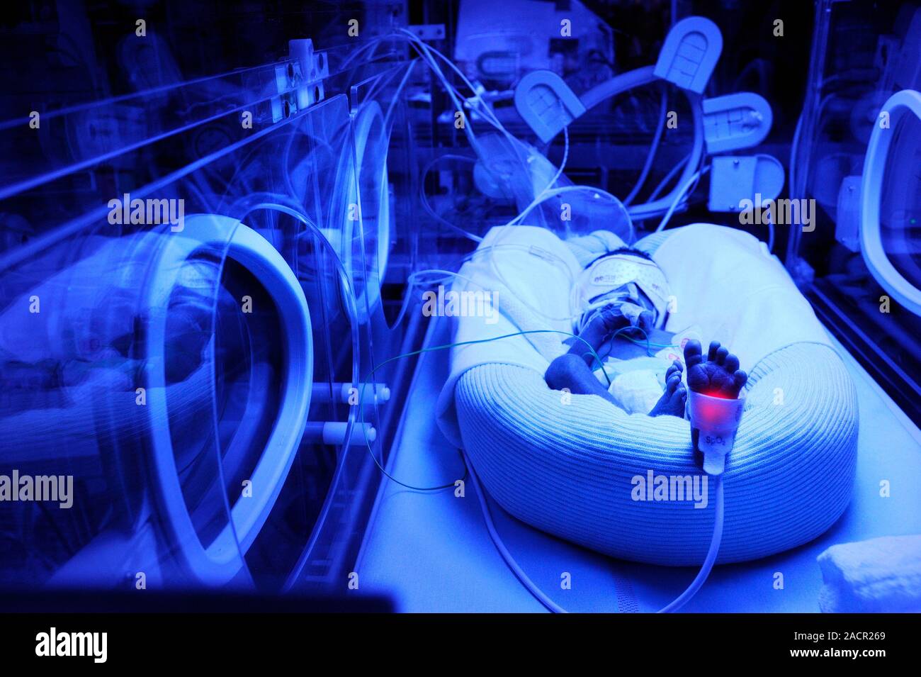Premature baby phototherapy. Premature baby in an incubator receiving ...