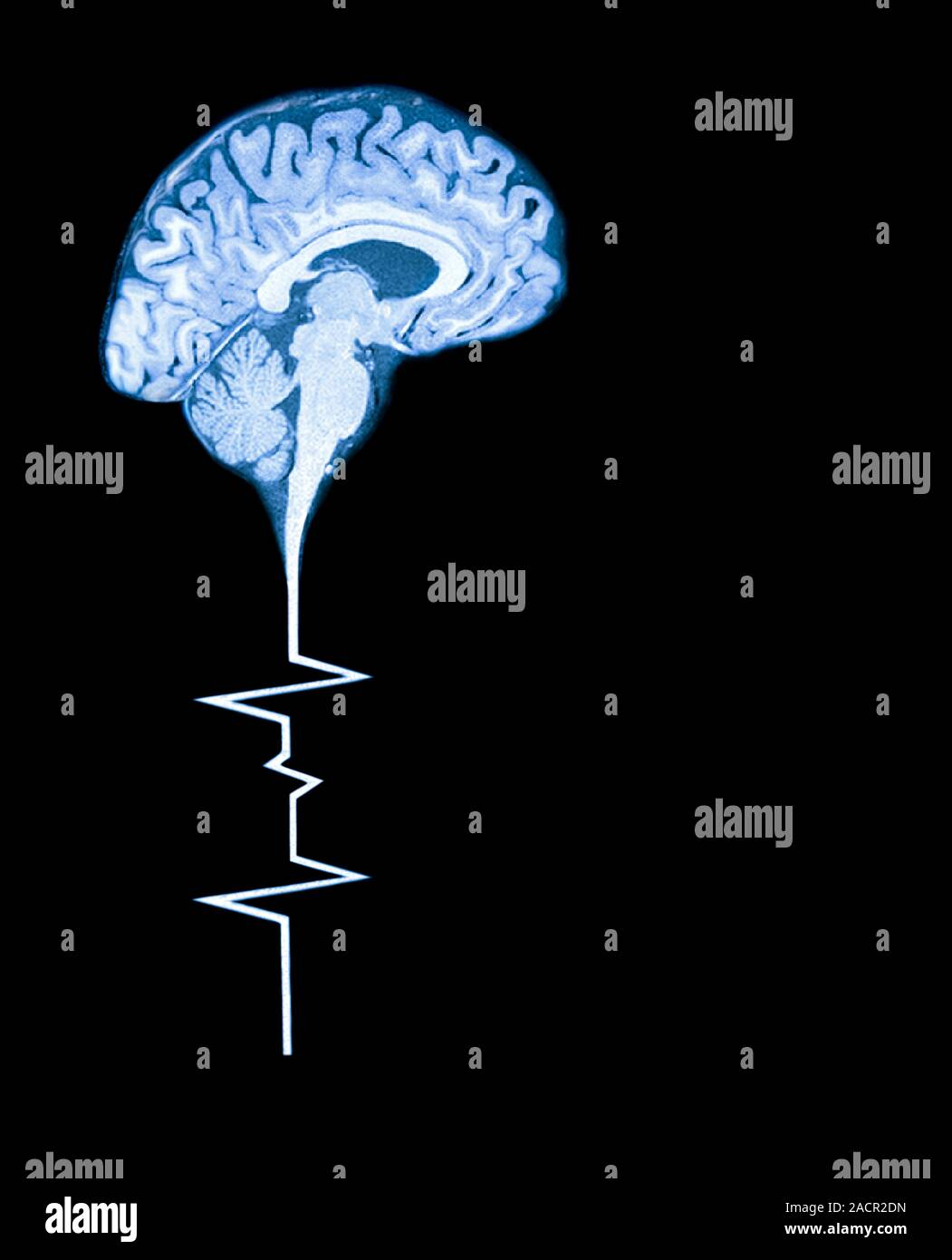 Brain. Coloured magnetic resonance imaging (MRI) scan of a sagittal section through a healthy ...