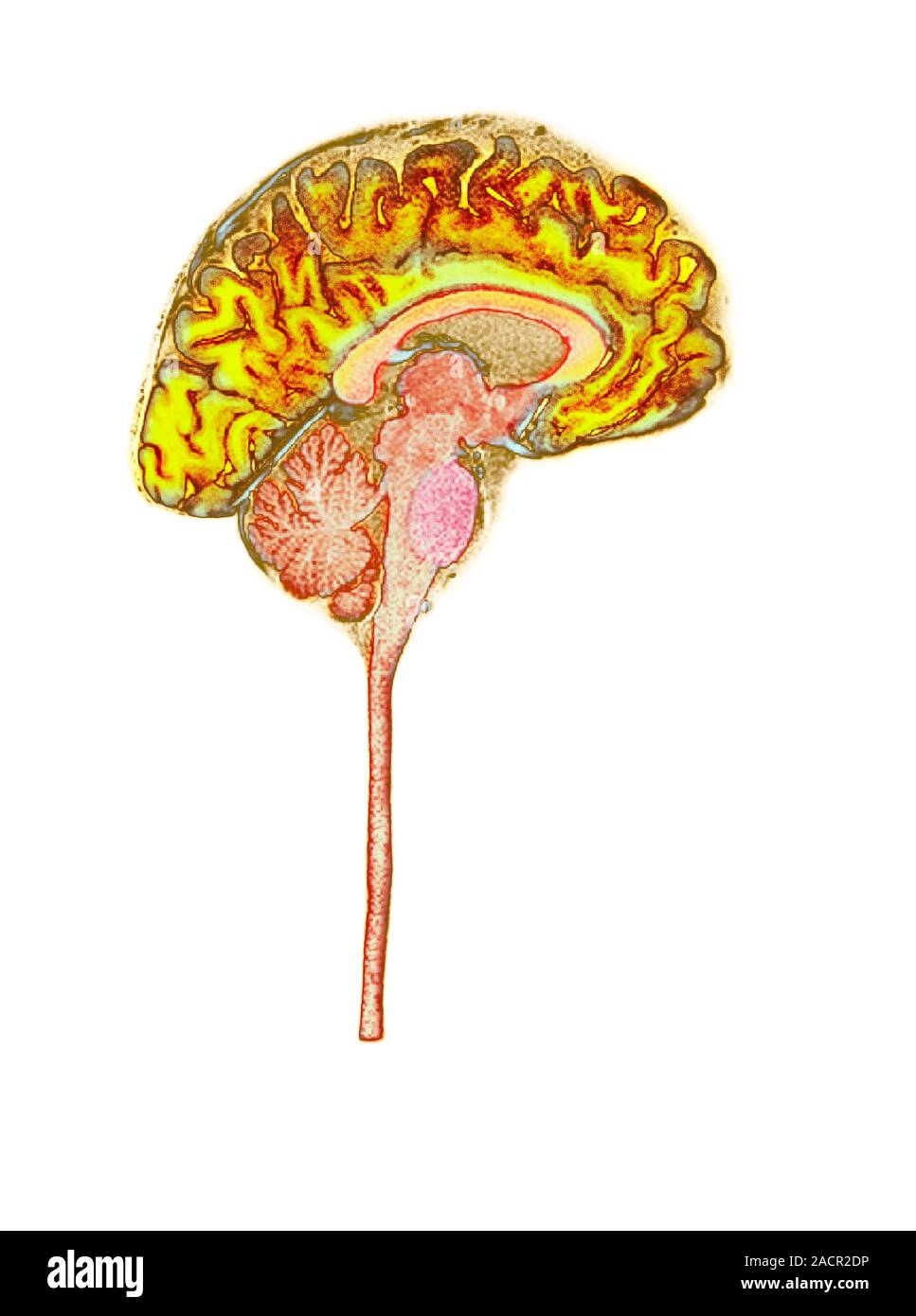 Brain. Coloured magnetic resonance imaging (MRI) scan of a sagittal section through a healthy ...