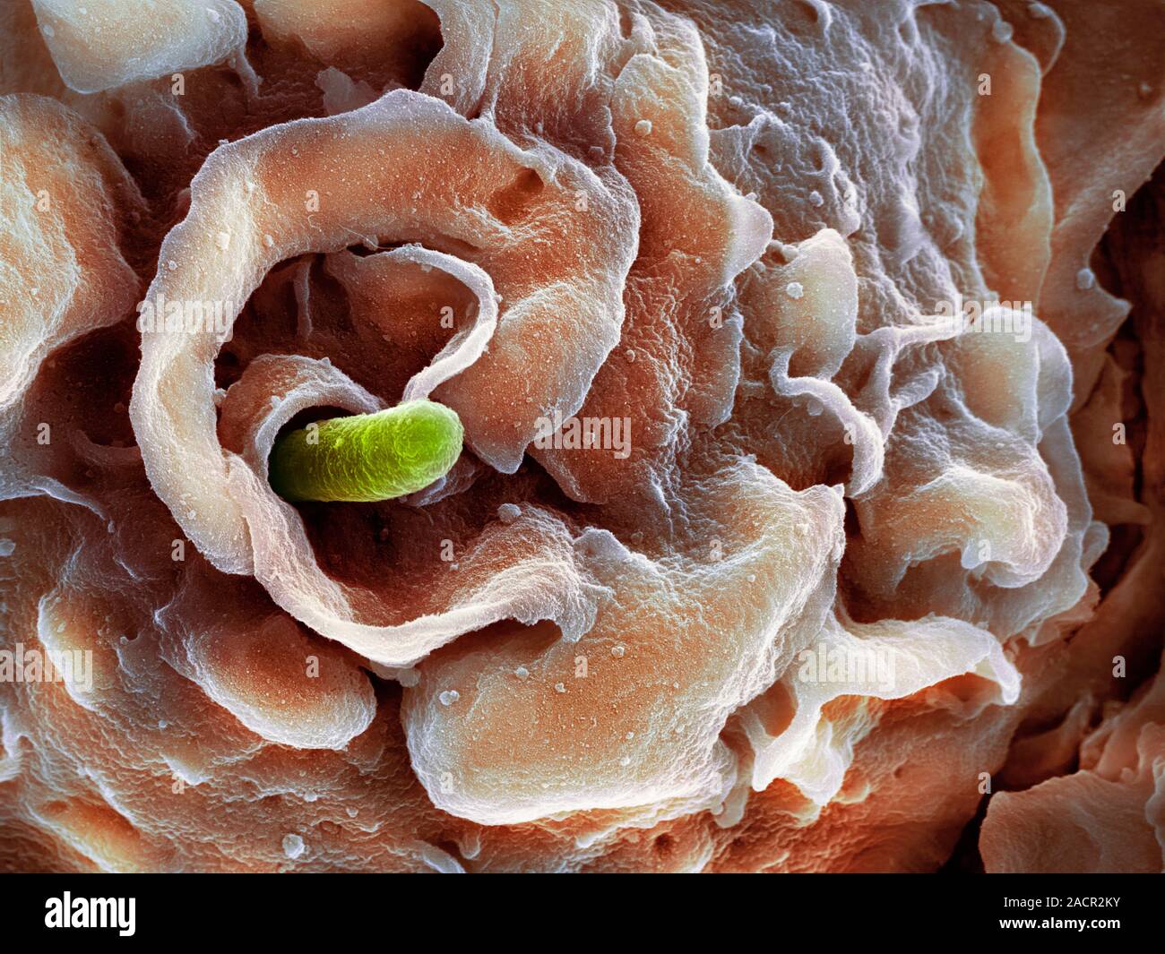 Shigella bacterium. Coloured scanning electron micrograph (SEM) of a ...