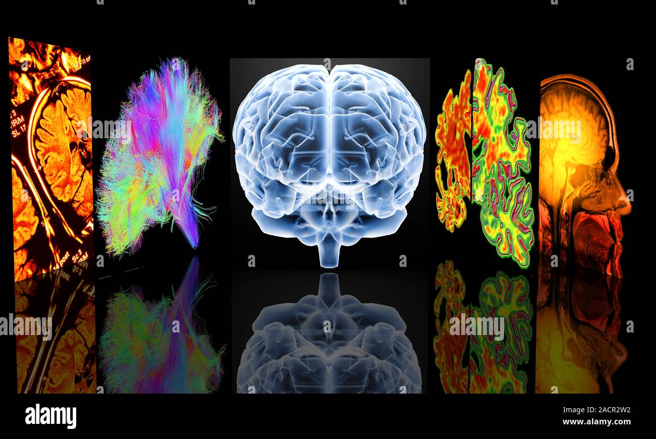 Conceptual computer artwork depicting neurology. From left to right ...