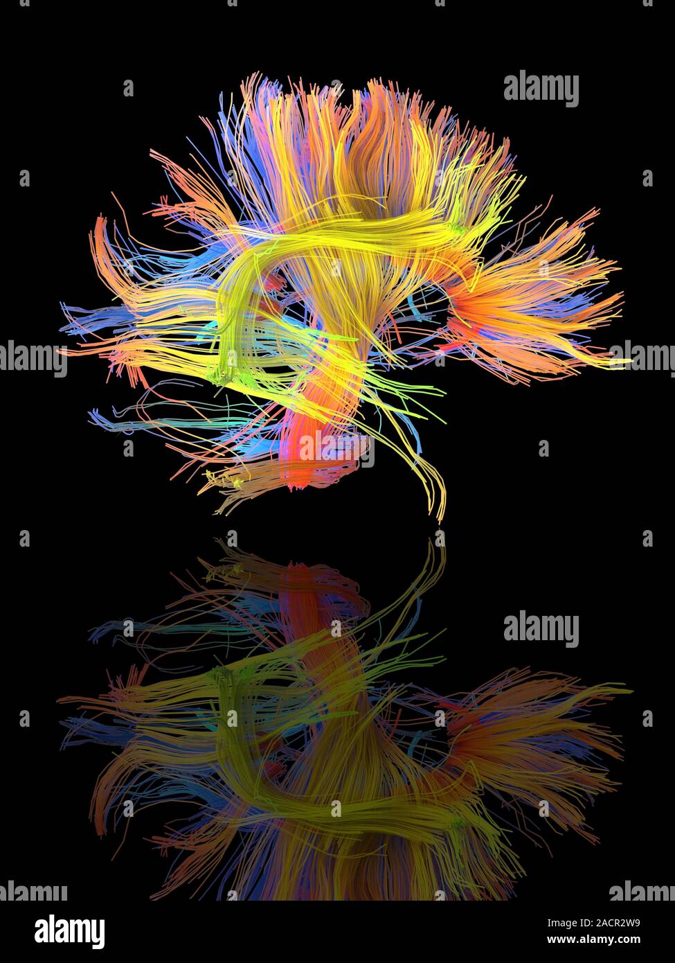 White matter fibres. Coloured 3D diffusion spectral imaging (DSI) scan ...