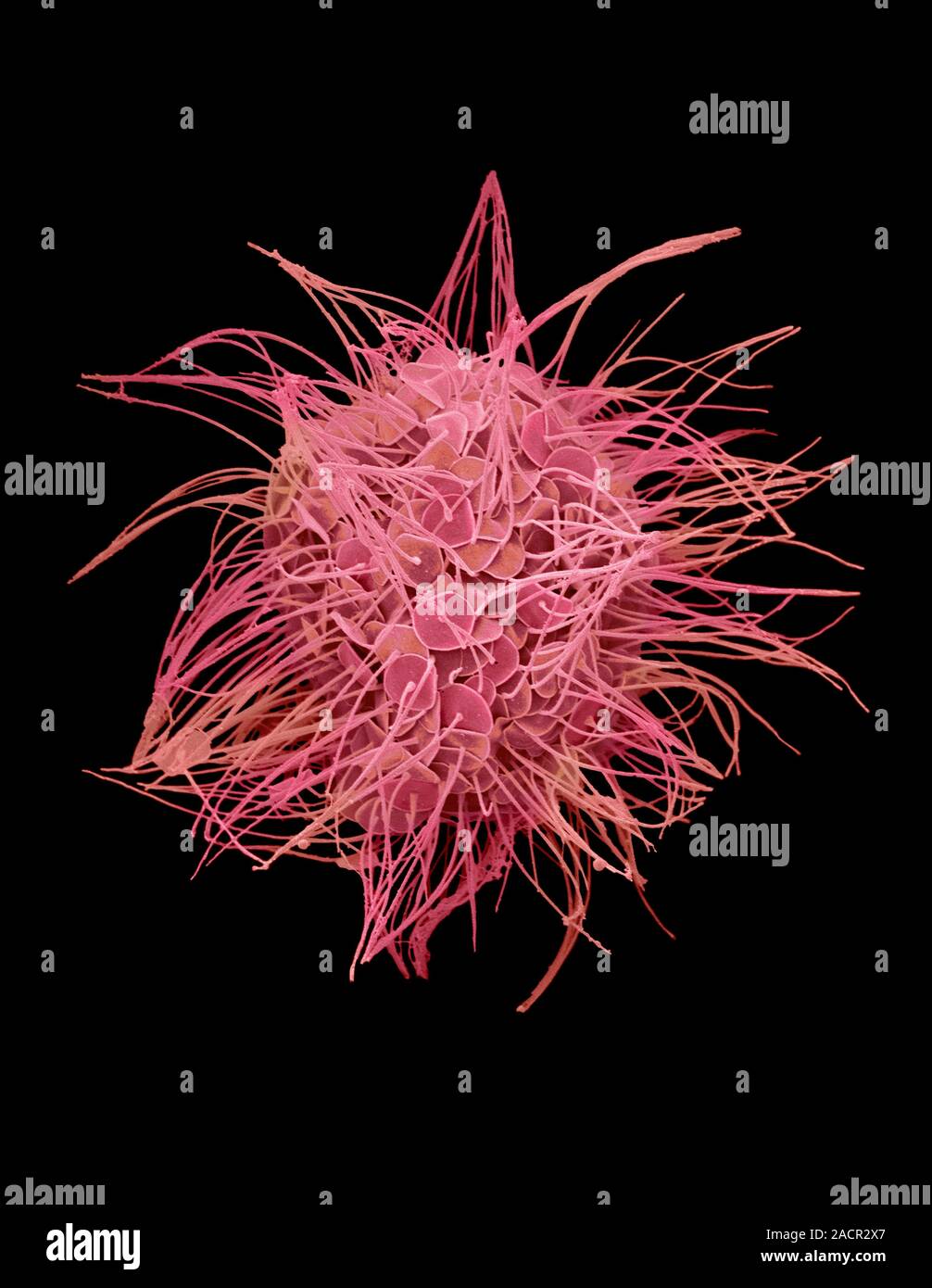 Heliozoan. Coloured scanning electron micrograph (SEM) of a heliozoan ...