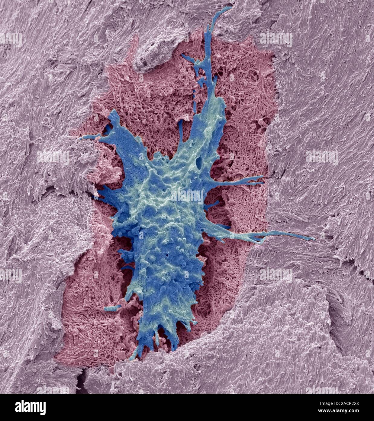 Osteocyte bone cell. Coloured scanning electron micrograph (SEM) of an ...