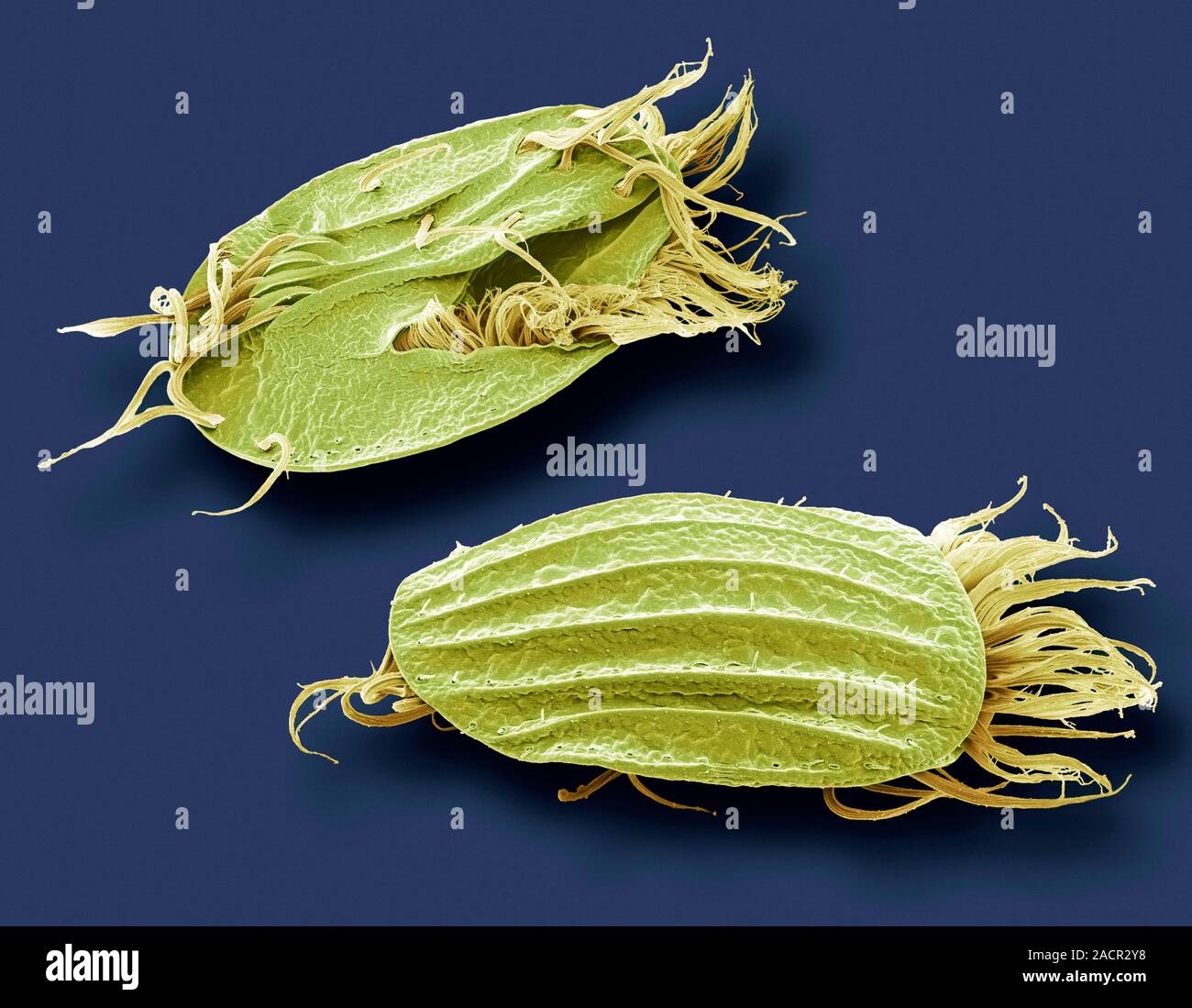 Euplotes protozoa. Coloured scanning electron micrograph (SEM) showing ...