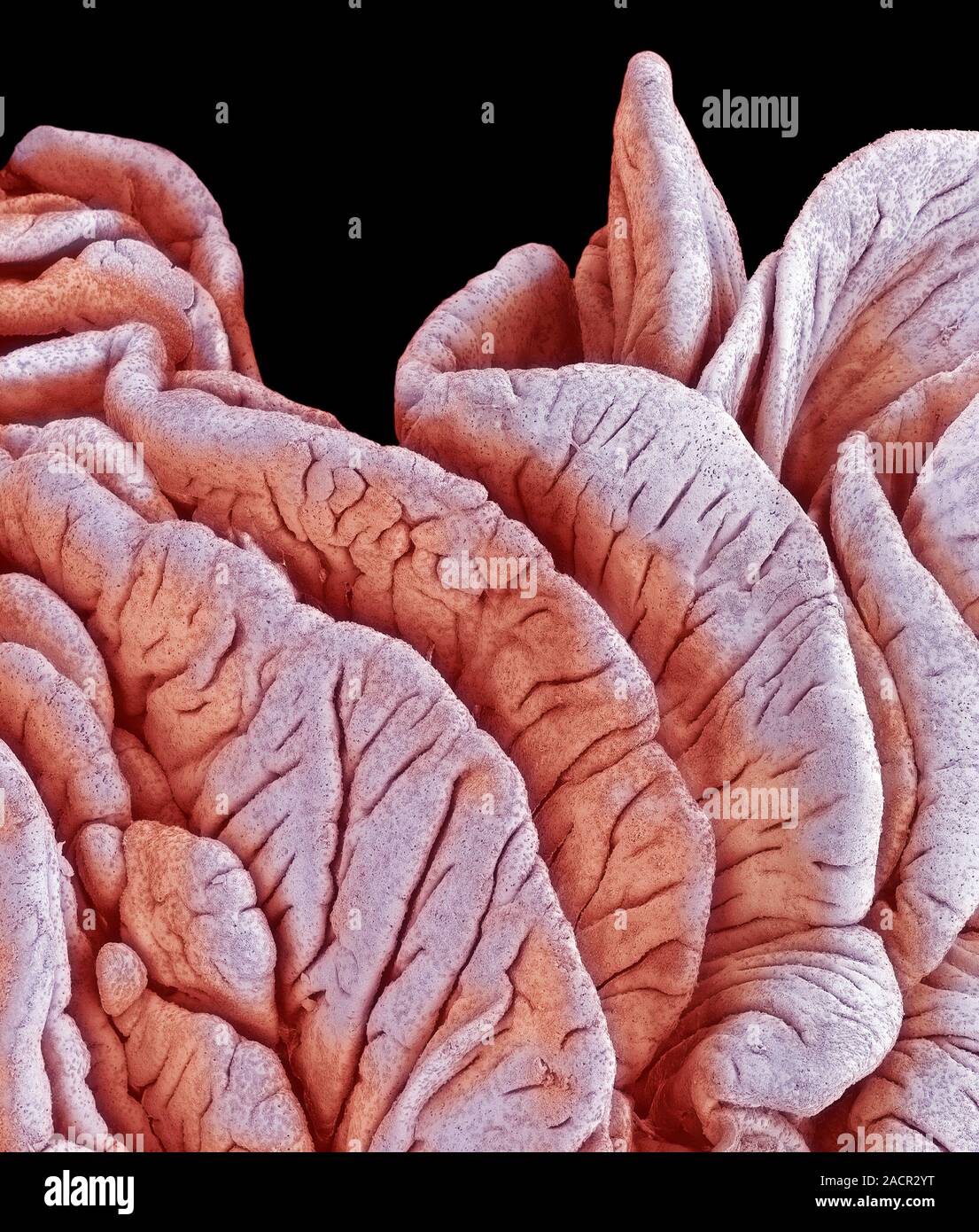 Fimbriae of a fallopian tube, coloured scanning electron micrograph ...