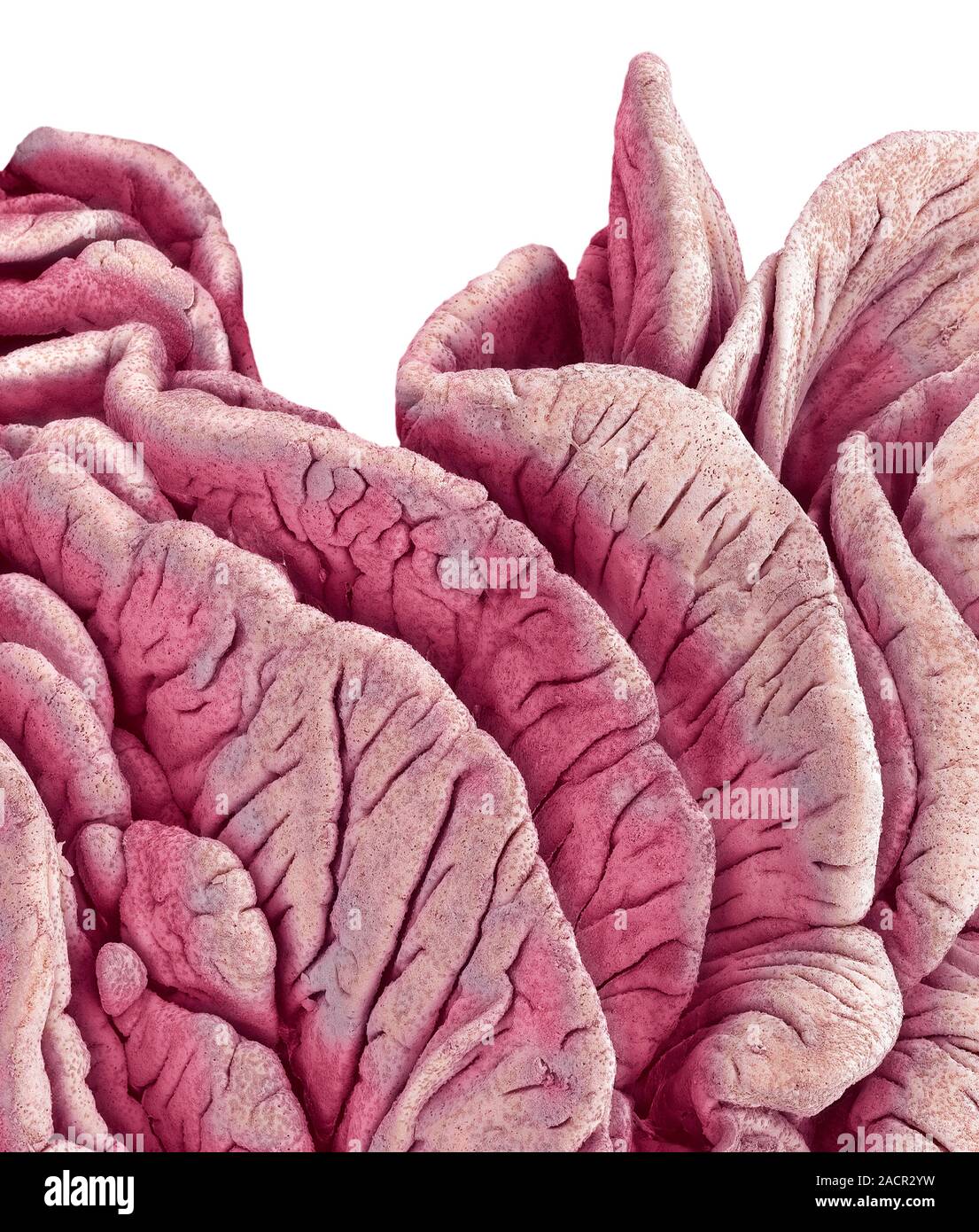 Fimbriae of a fallopian tube, coloured scanning electron micrograph ...