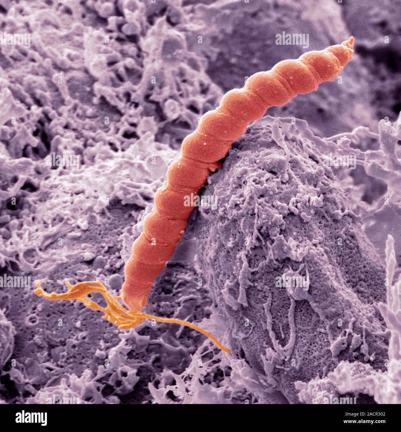 Helicobacter pylori bacteria. Coloured scanning electron micrograph ...