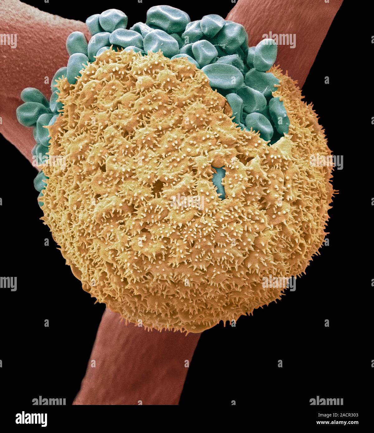 Bread mould. Coloured scanning electron micrograph (SEM) of a black ...