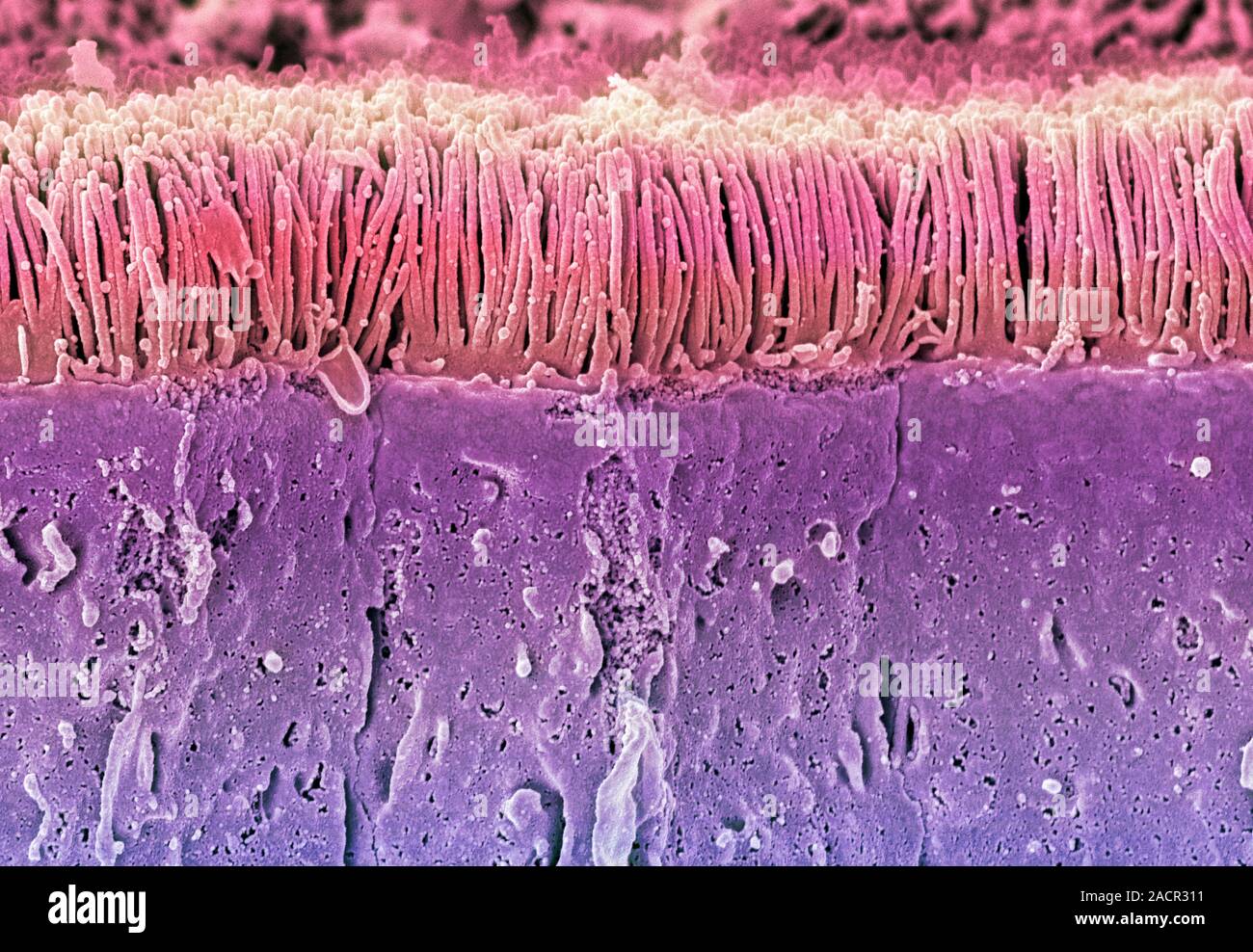 Intestinal microvilli. Coloured scanning electron micrograph (SEM) of a ...