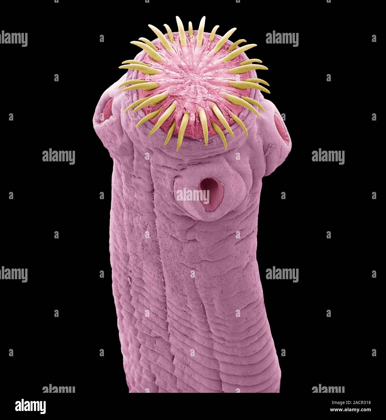 Taenia Solium Cysticercus Labels