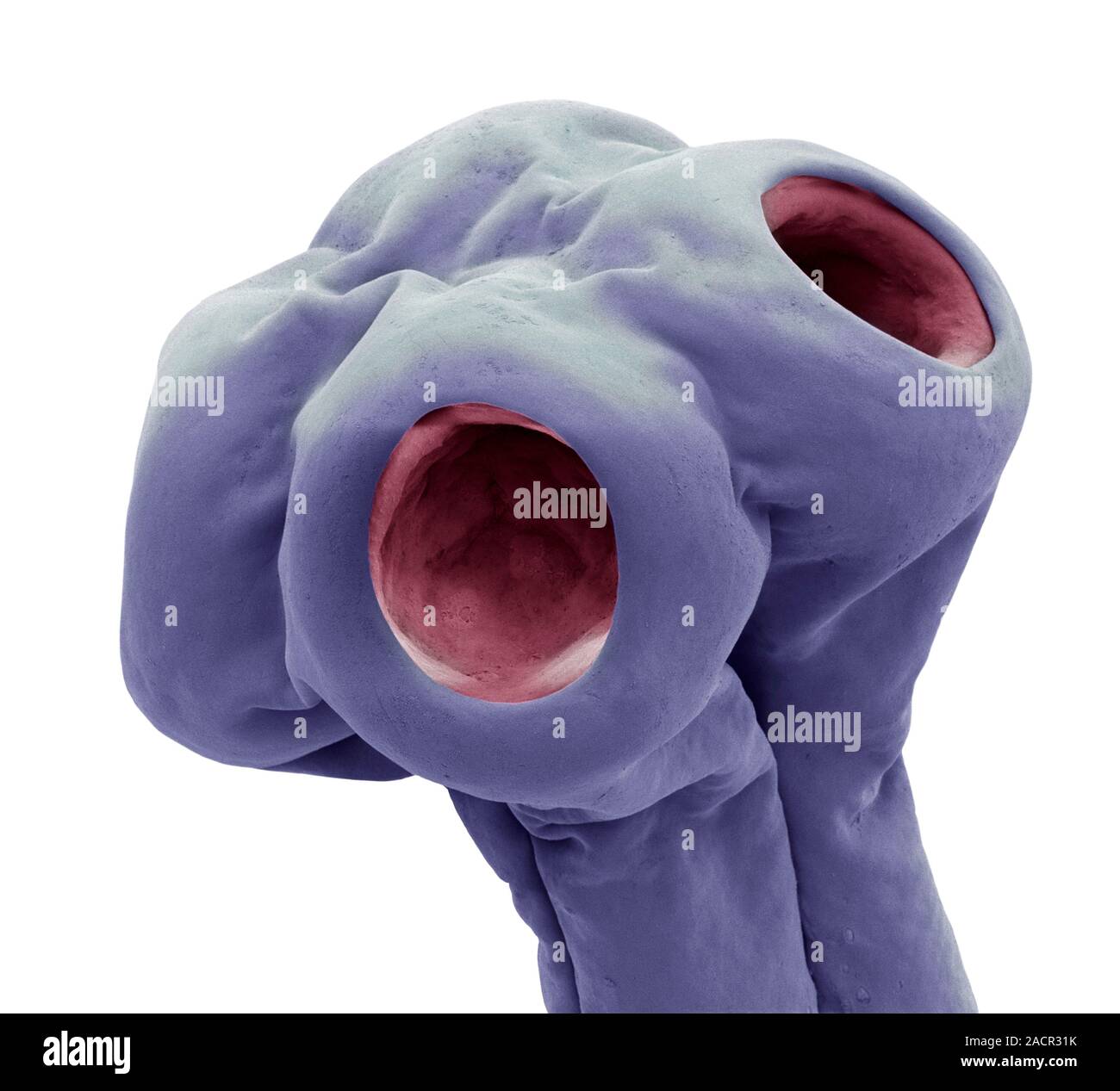 Beef tapeworm. Coloured scanning electron micrograph (SEM) of the head ...