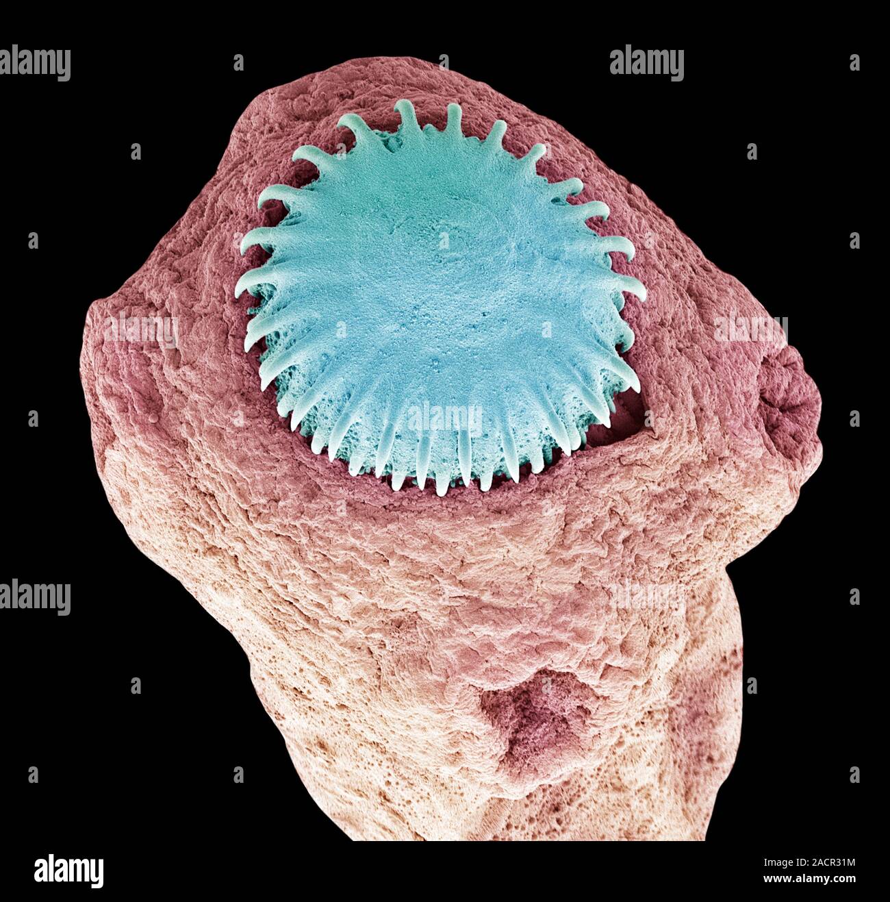 Tapeworm. Coloured scanning electron micrograph (SEM) of the head of a ...