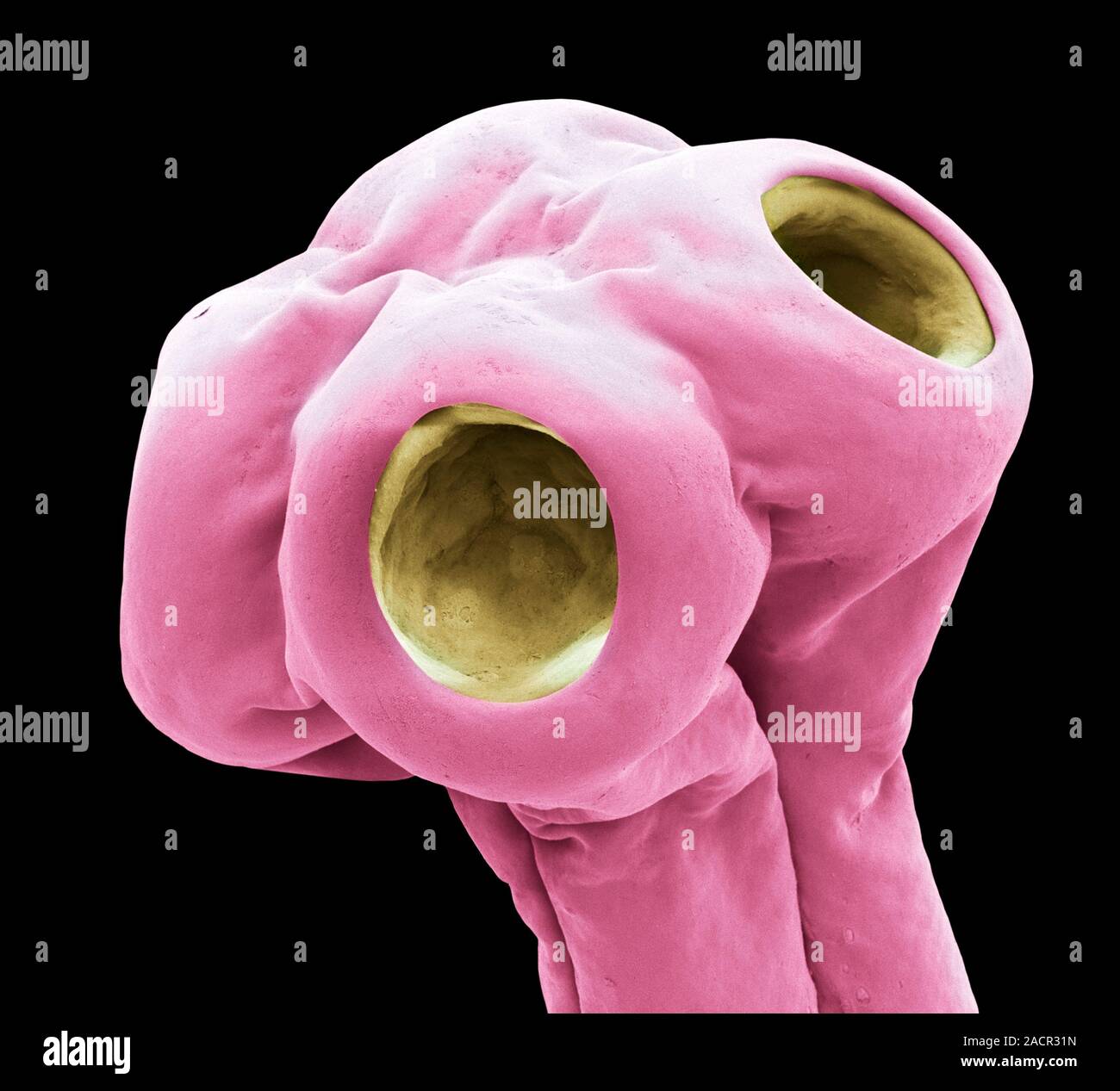 Beef tapeworm. Coloured scanning electron micrograph (SEM) of the head ...