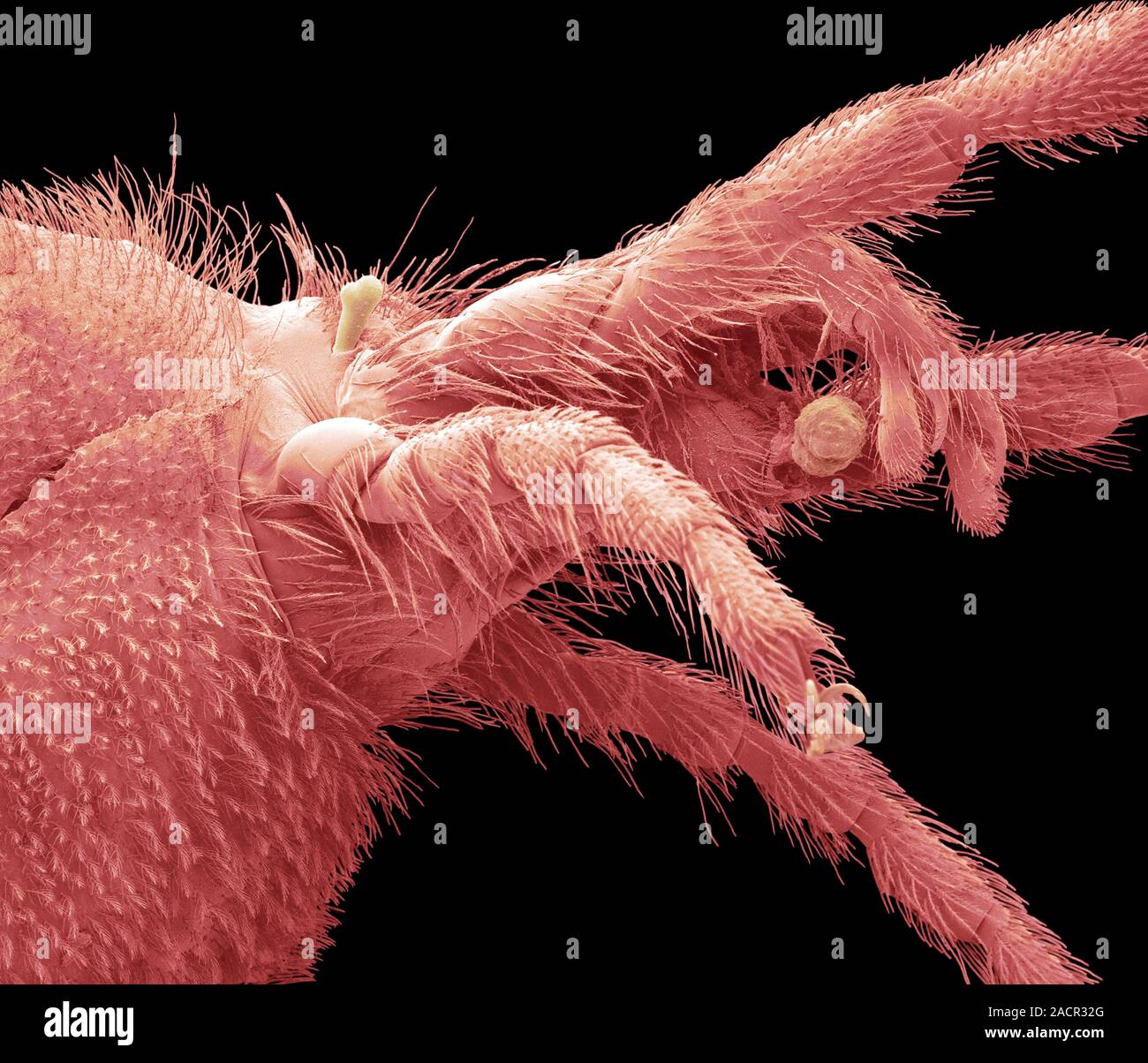 Velvet mite. Coloured scanning electron micrograph (SEM) of the head of ...