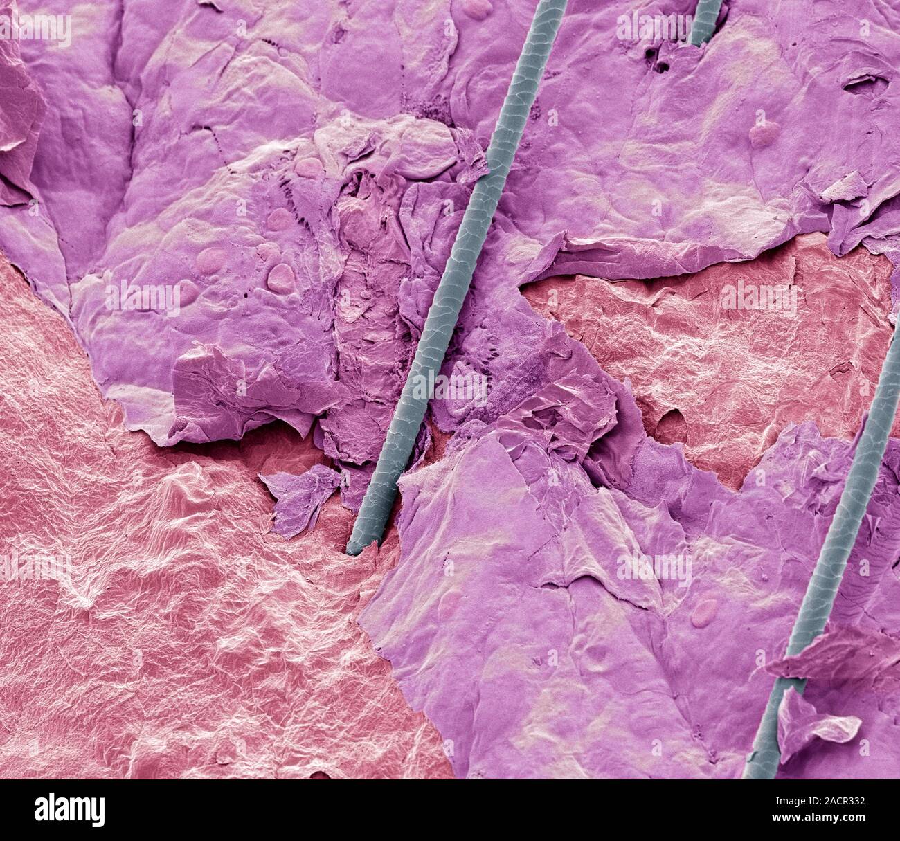 Foetal skin. Coloured scanning electron micrograph (SEM) of skin on the ...