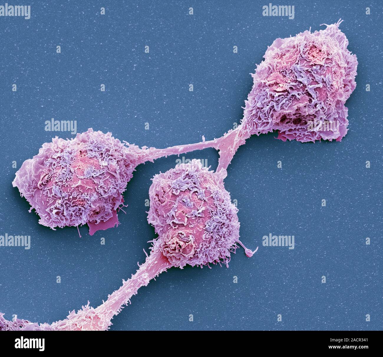Microglial white blood cells. Coloured scanning electron micrograph ...