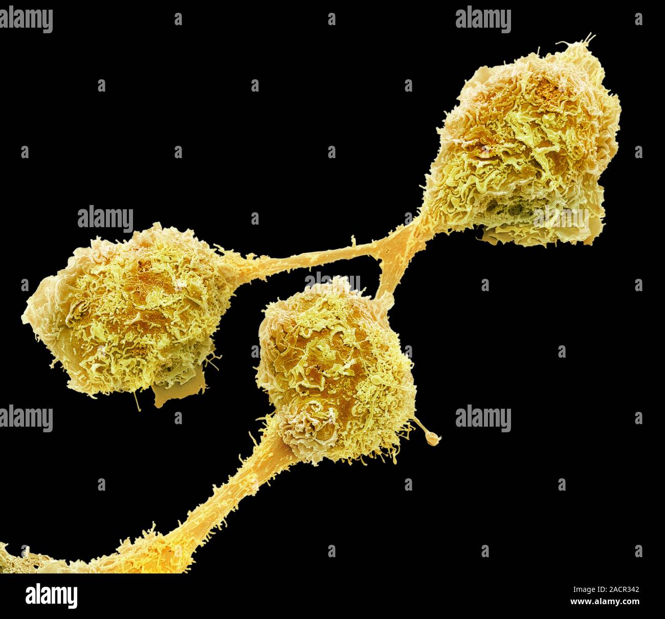 Microglial white blood cells. Coloured scanning electron micrograph ...