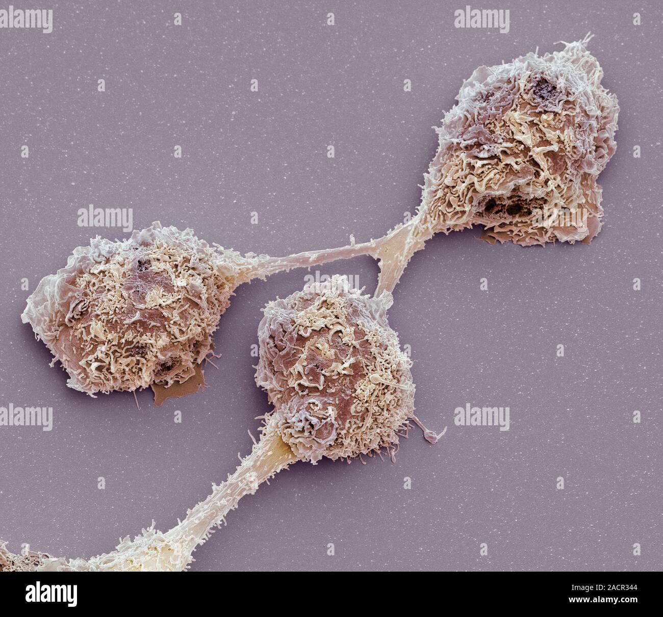 Microglial white blood cells. Coloured scanning electron micrograph ...