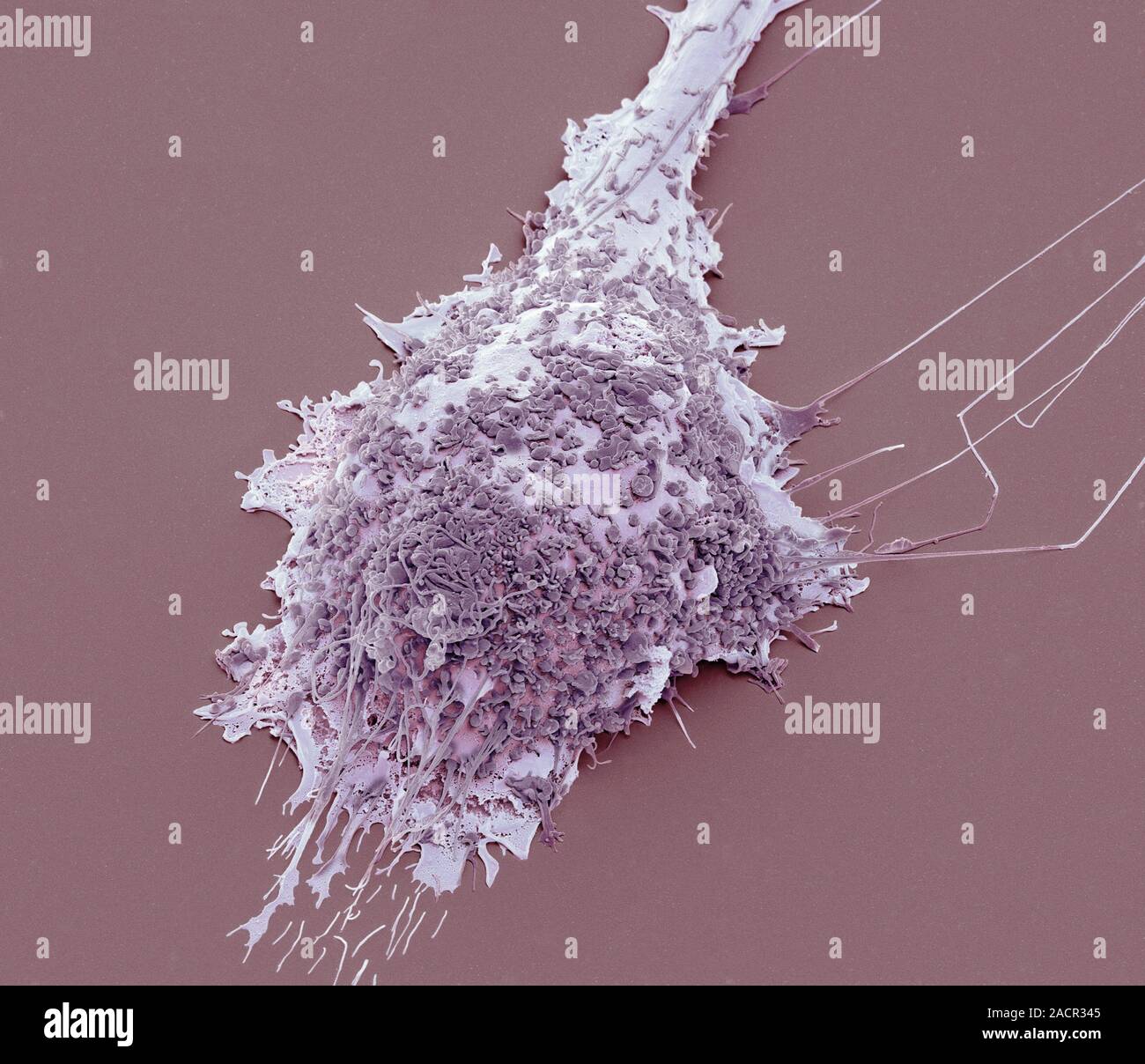 Microglial white blood cell. Coloured scanning electron micrograph (SEM ...