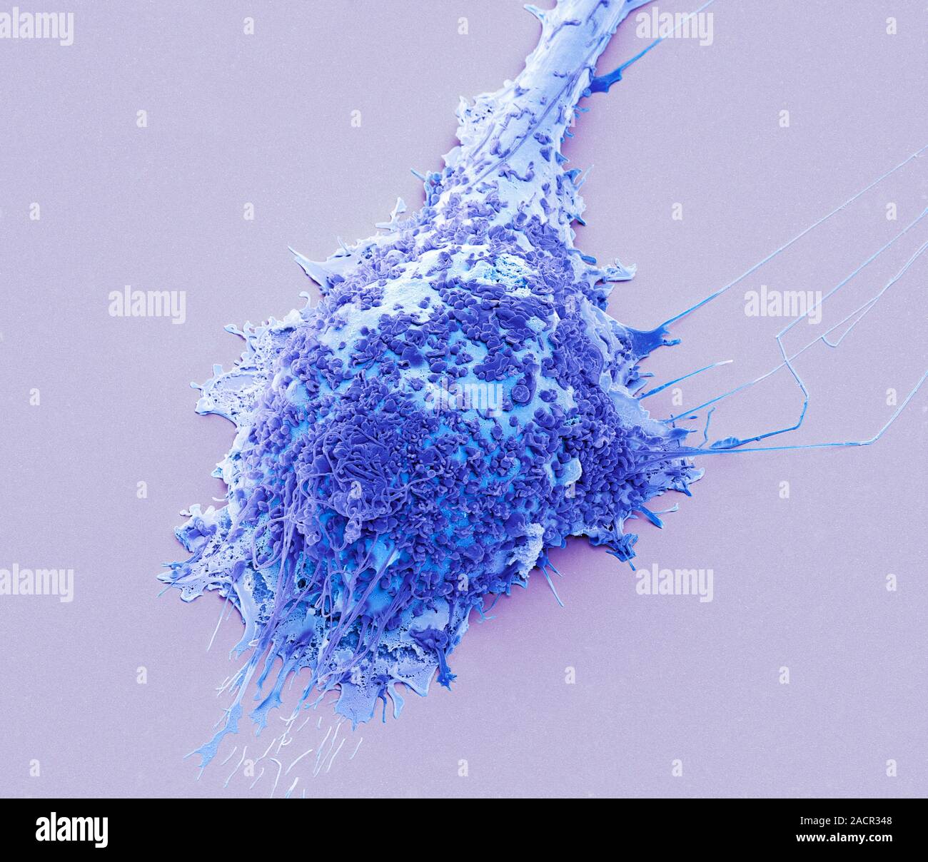 Microglial white blood cell. Coloured scanning electron micrograph (SEM ...