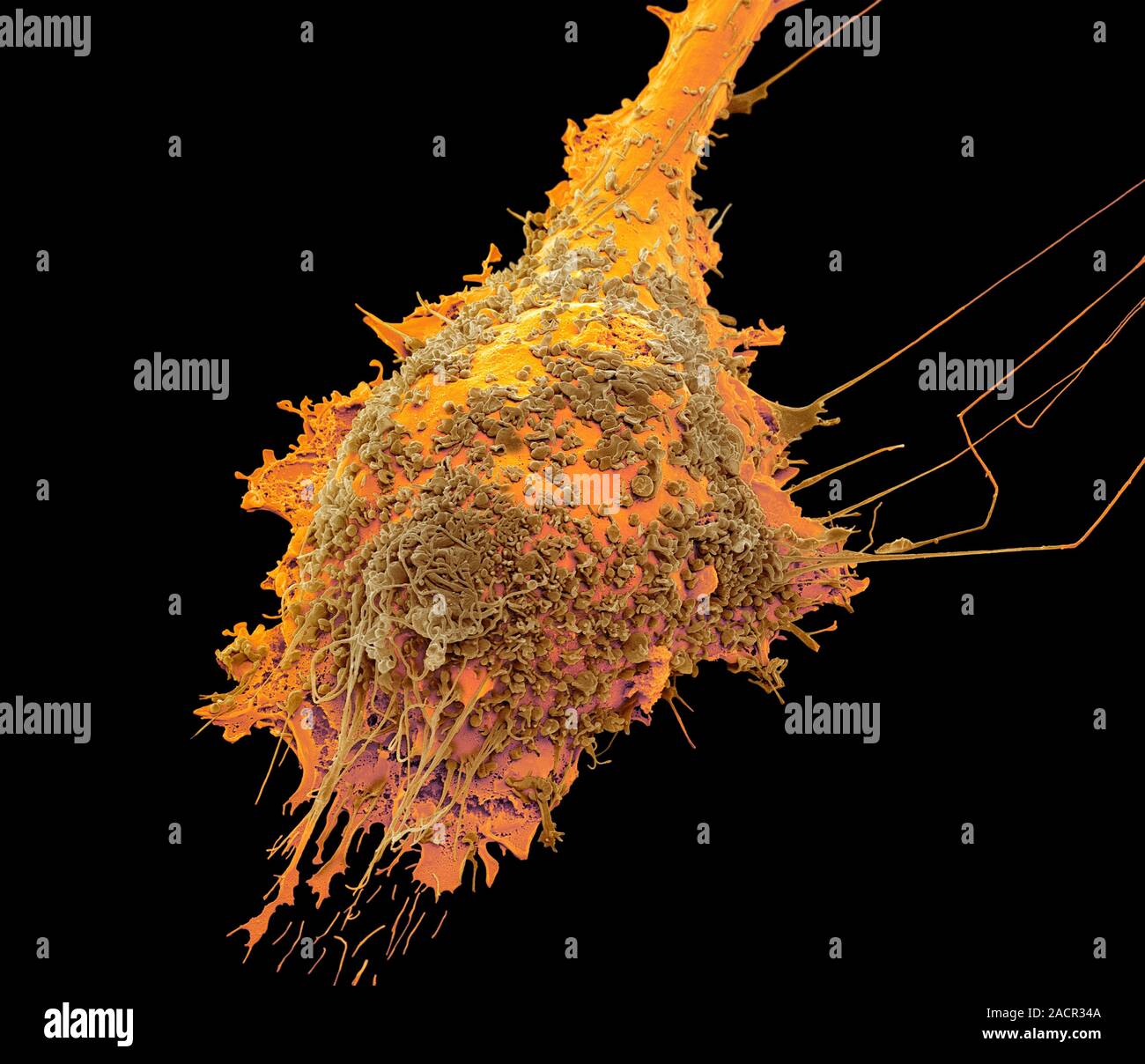 Microglial white blood cell. Coloured scanning electron micrograph (SEM ...