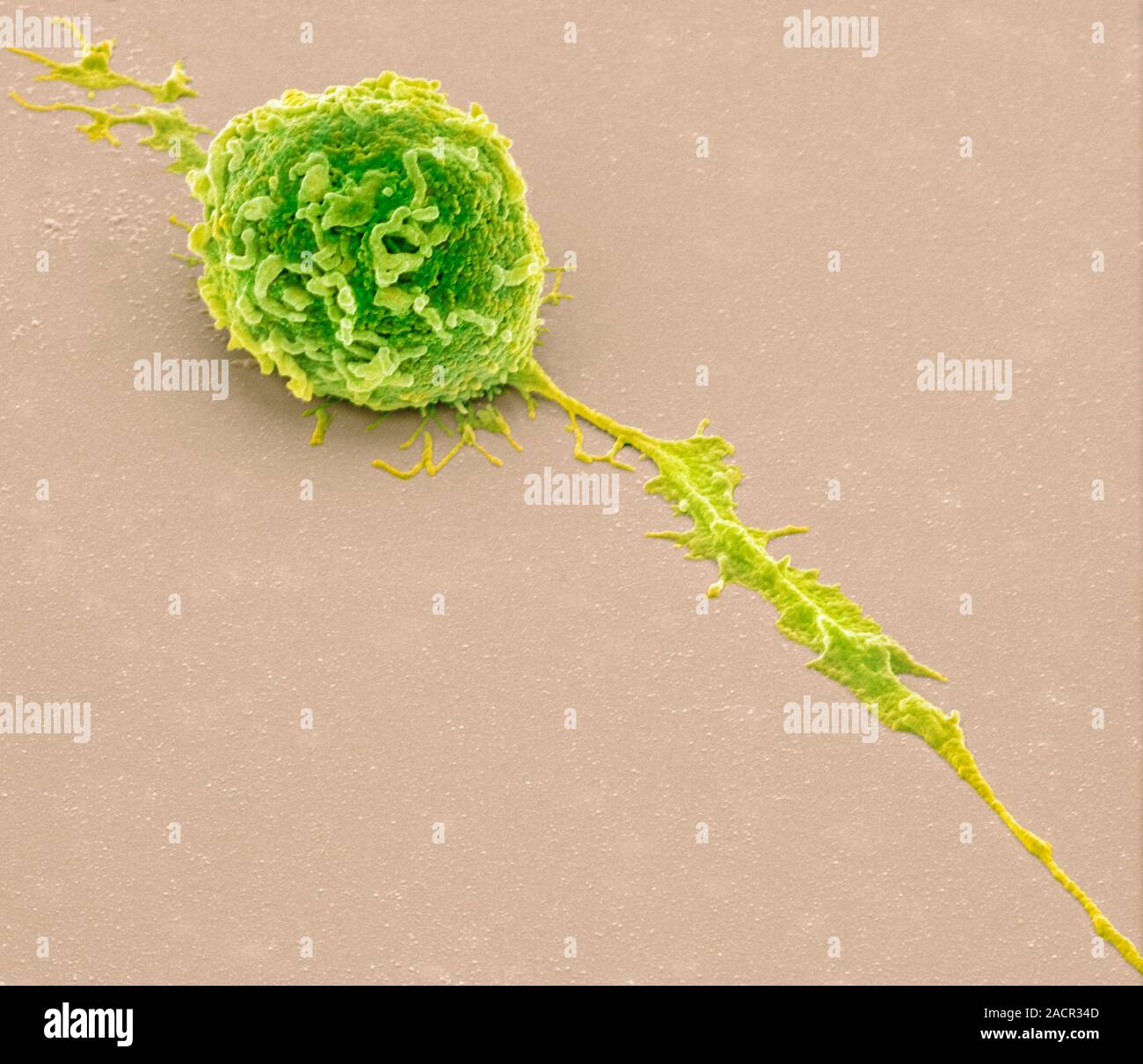 Microglial white blood cell. Coloured scanning electron micrograph (SEM ...