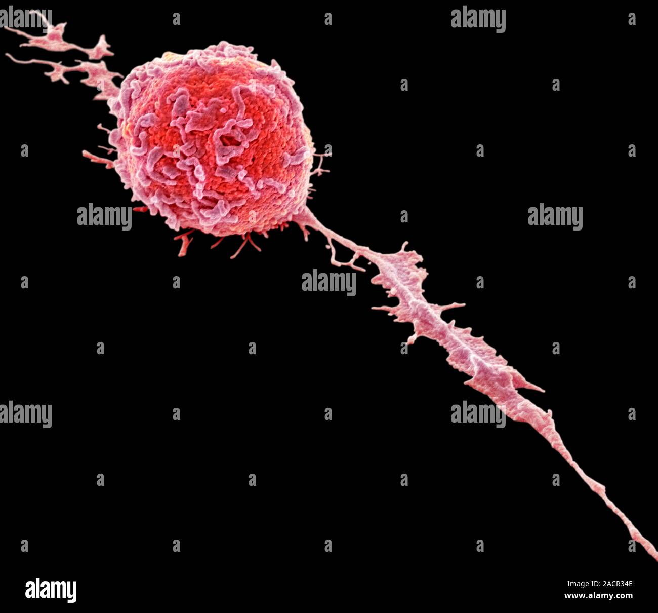 Microglial white blood cell. Coloured scanning electron micrograph (SEM ...