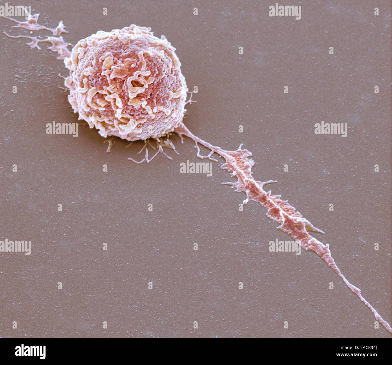 Microglial white blood cell. Coloured scanning electron micrograph (SEM ...