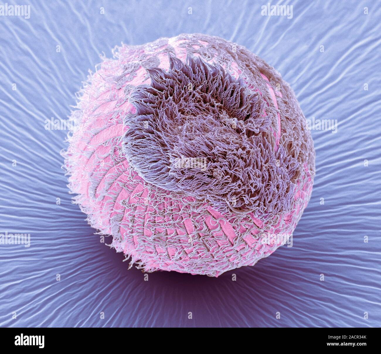 Climacostomum protozoan. Coloured scanning electron micrograph (SEM) of ... Climacostomum protozoan. Coloured scanning electron micrograph (SEM) of ...