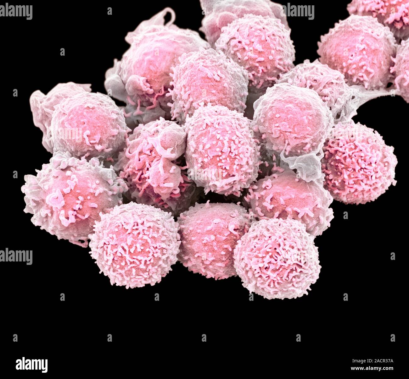 Lymphocyte white blood cells. Coloured scanning electron micrograph ...