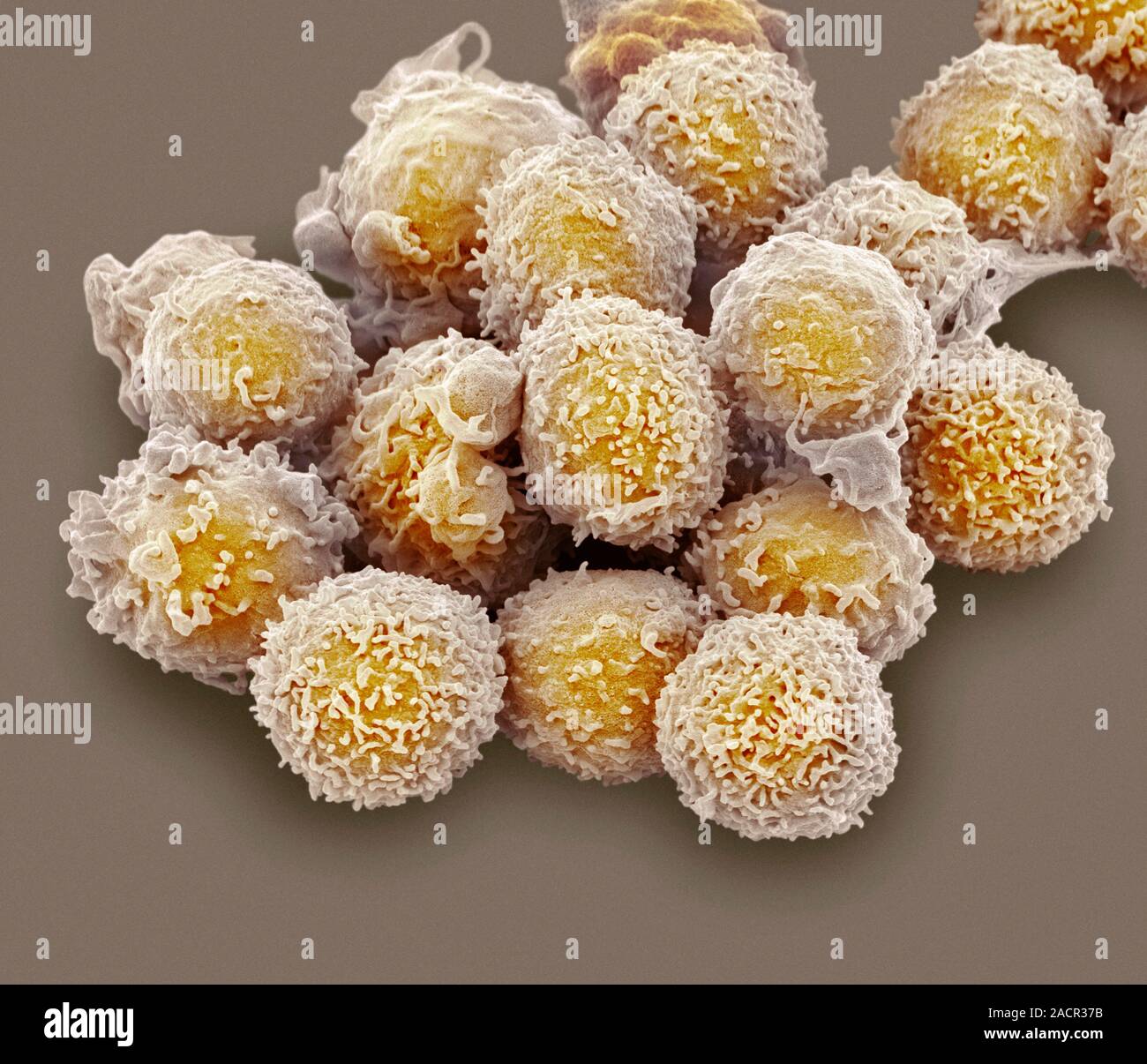 Lymphocyte white blood cells. Coloured scanning electron micrograph ...