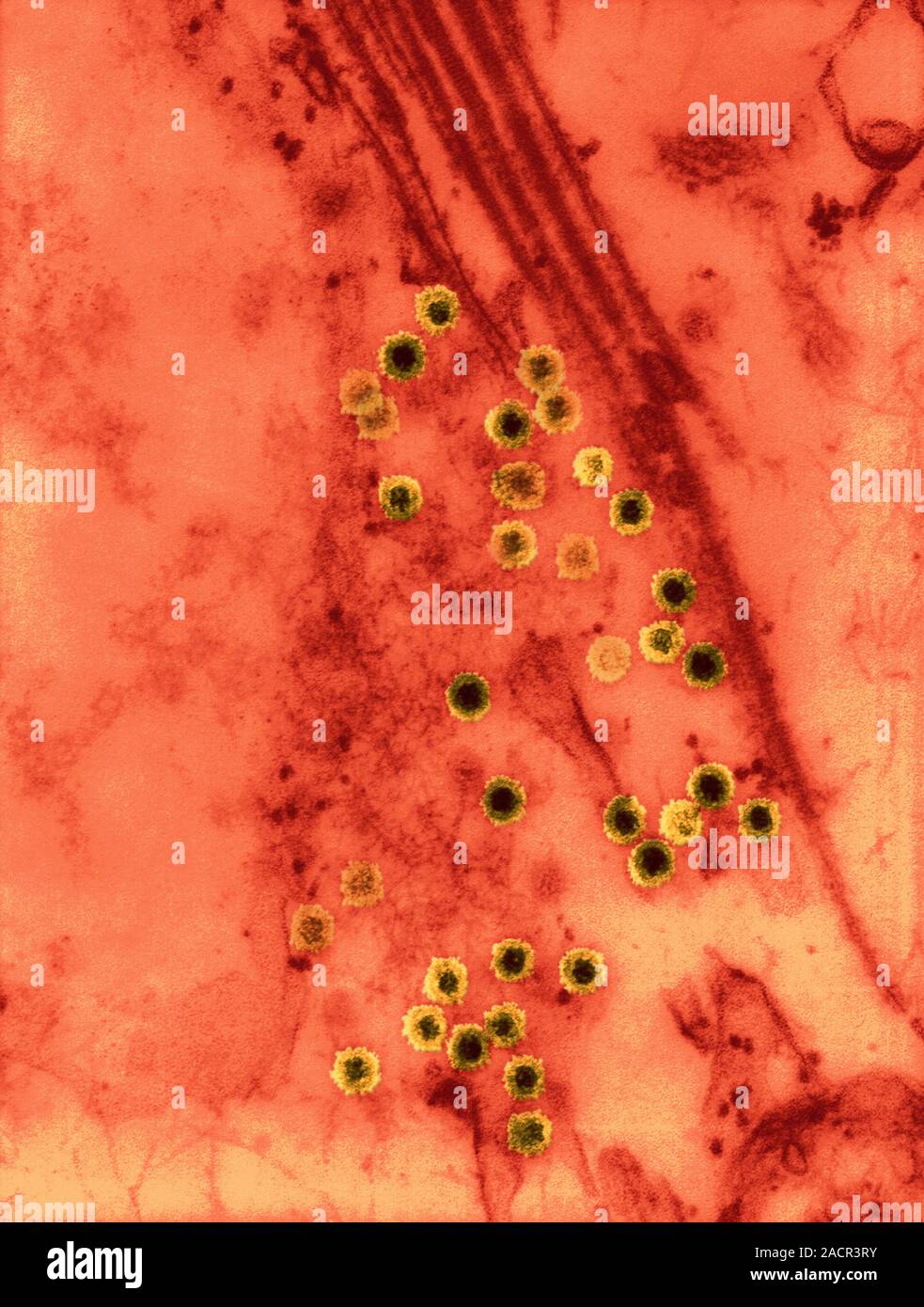 Colorado tick fever virus infection. Transmission electron micrograph ...