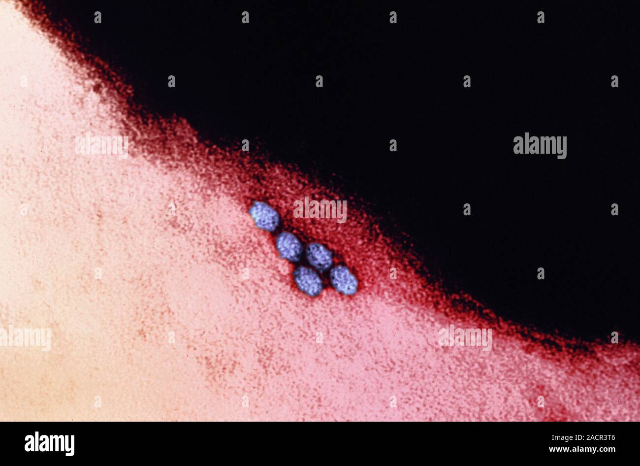 Acute haemorrhagic conjunctivitis. Transmission electron micrograph ...