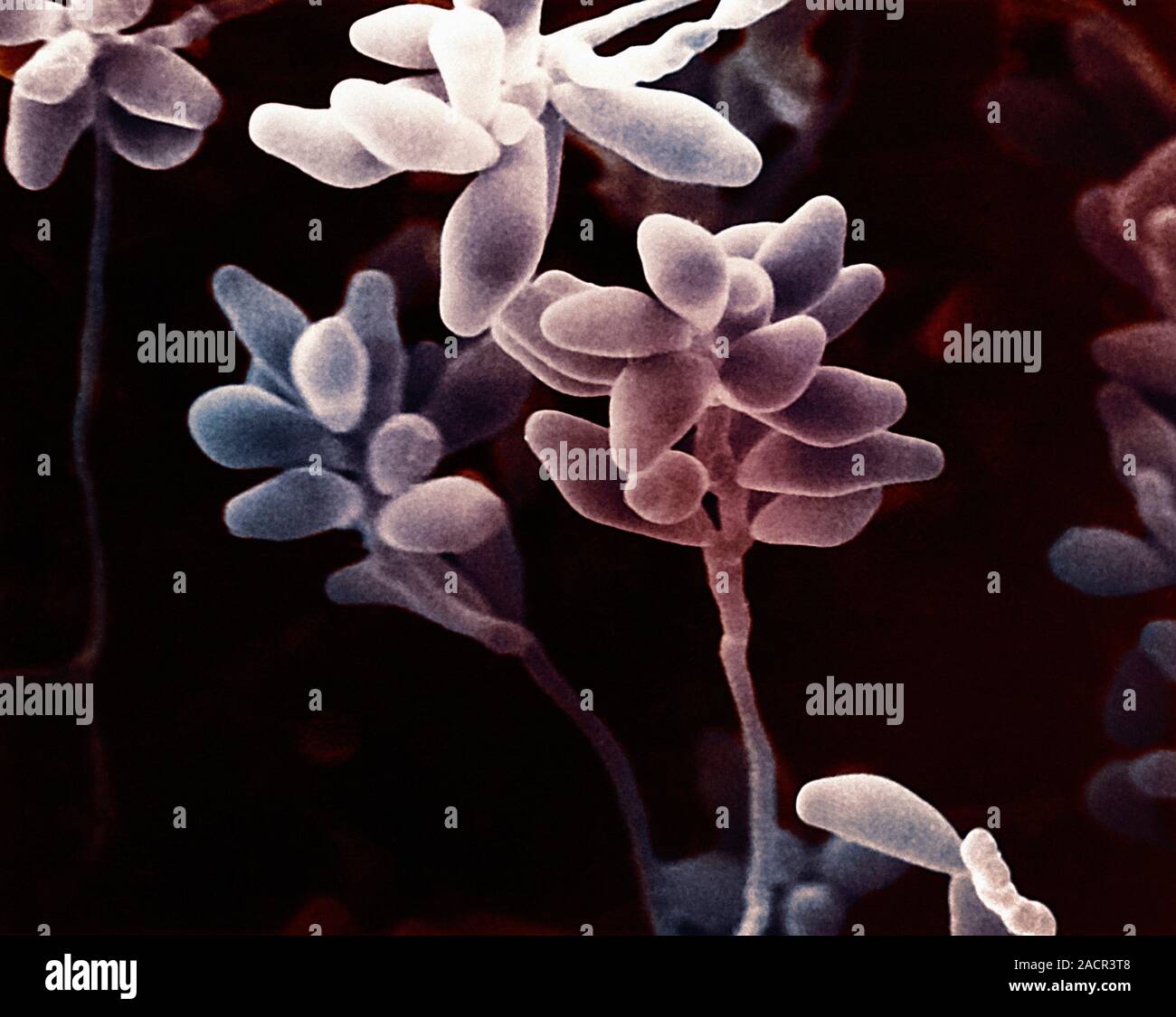 Curvularia geniculata fungus. Coloured scanning electron micrograph ... Curvularia geniculata fungus. Coloured scanning electron micrograph ...